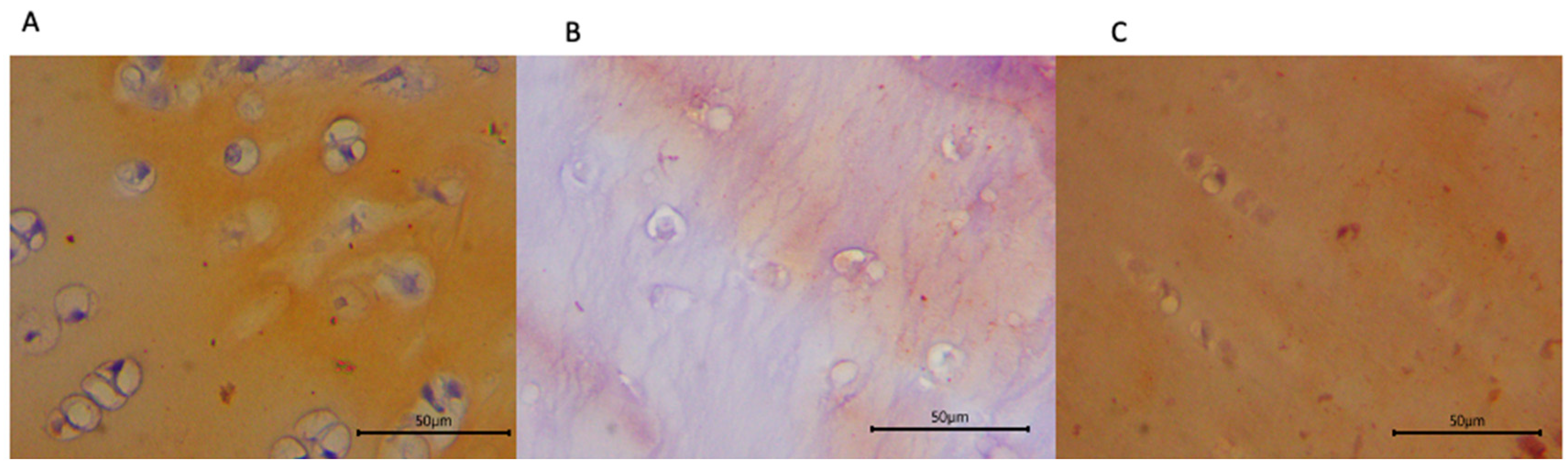 Intra-Articular Injection of Adipose-Derived-MSC Exosomes and ...