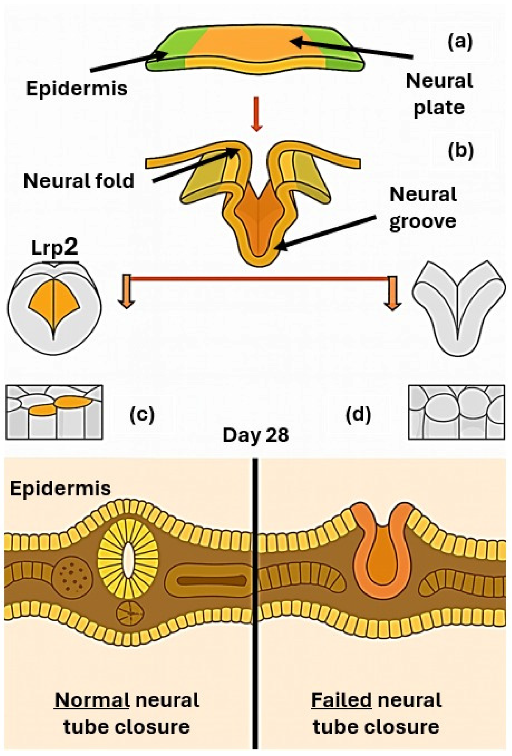 Advances in Fetal Repair of Spina Bifida Integrating Prenatal Surgery ...