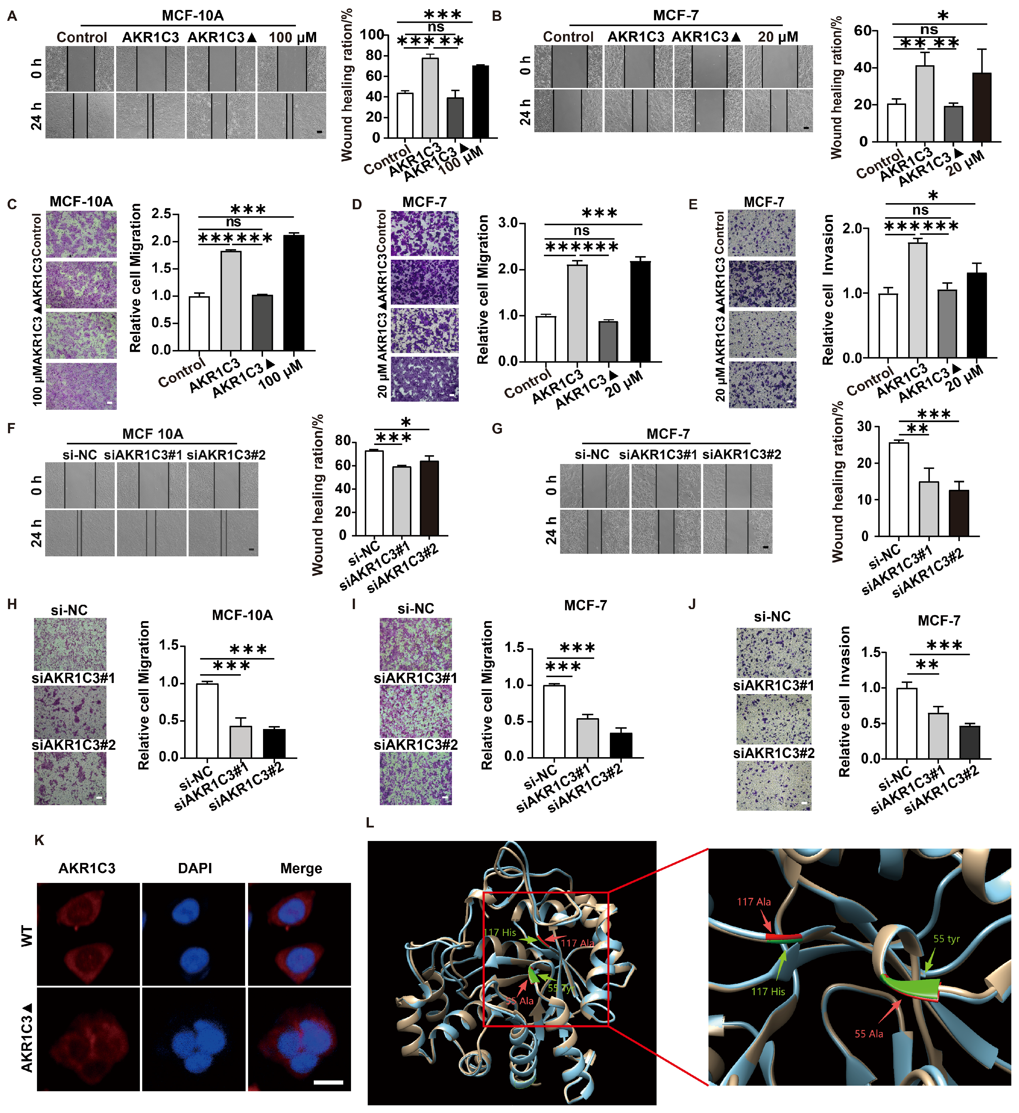 Environmental Lead Promotes Breast Cancer Migration and Invasion via ...