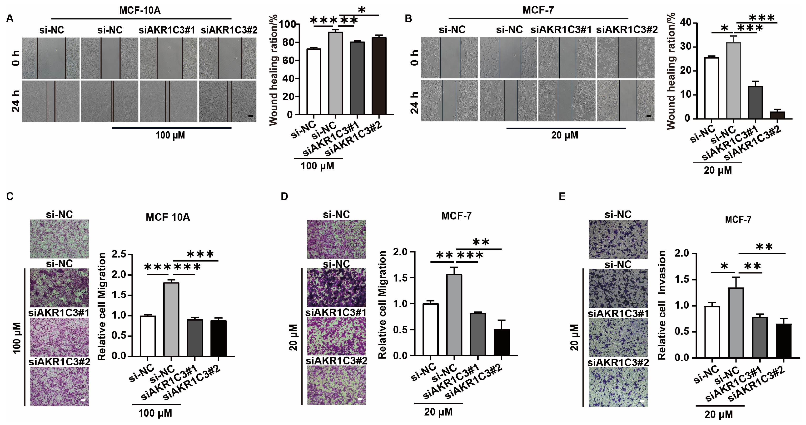 Environmental Lead Promotes Breast Cancer Migration and Invasion via ...