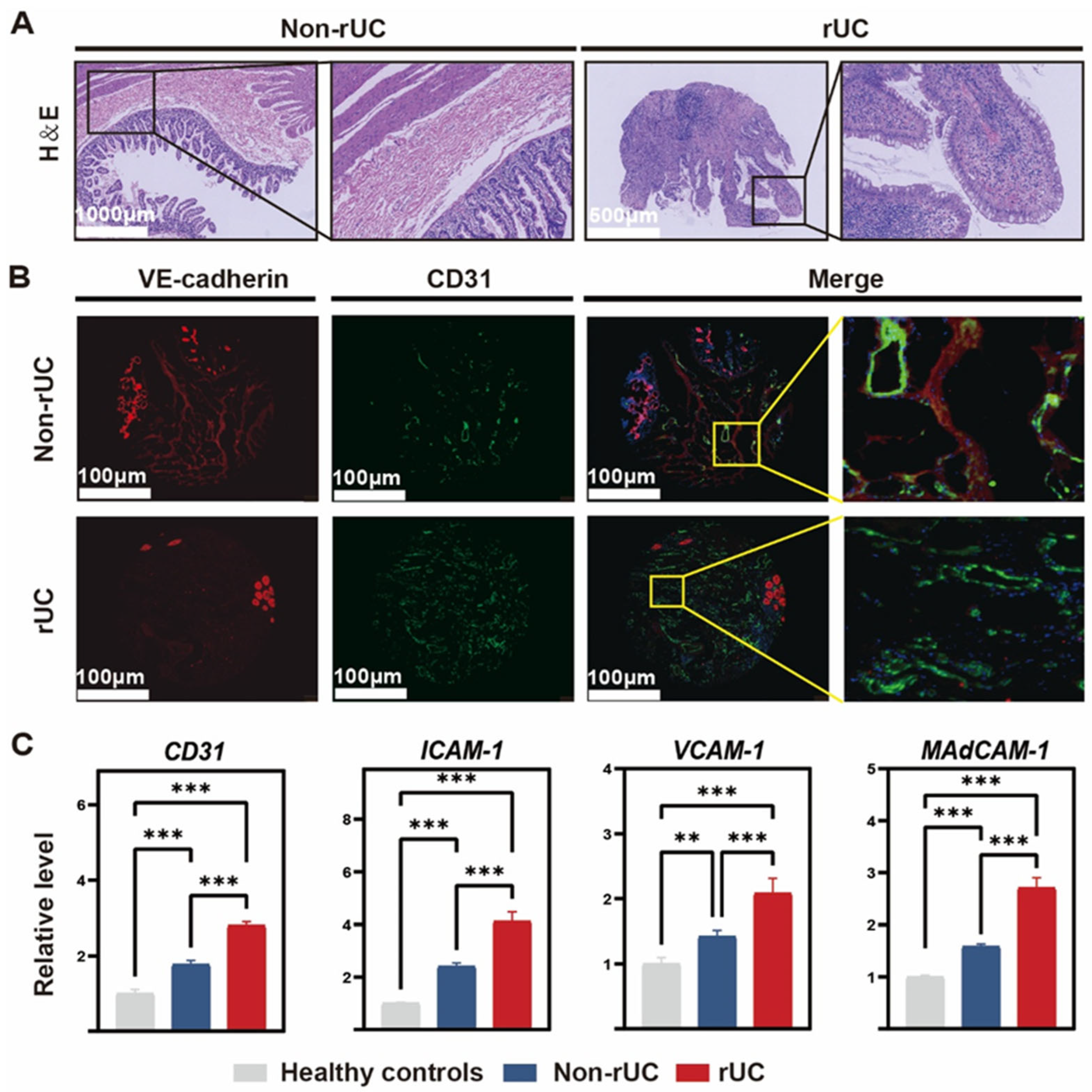 Recombinant BMP9 Reinforces Gut Vascular Barrier in Experimental Colitis