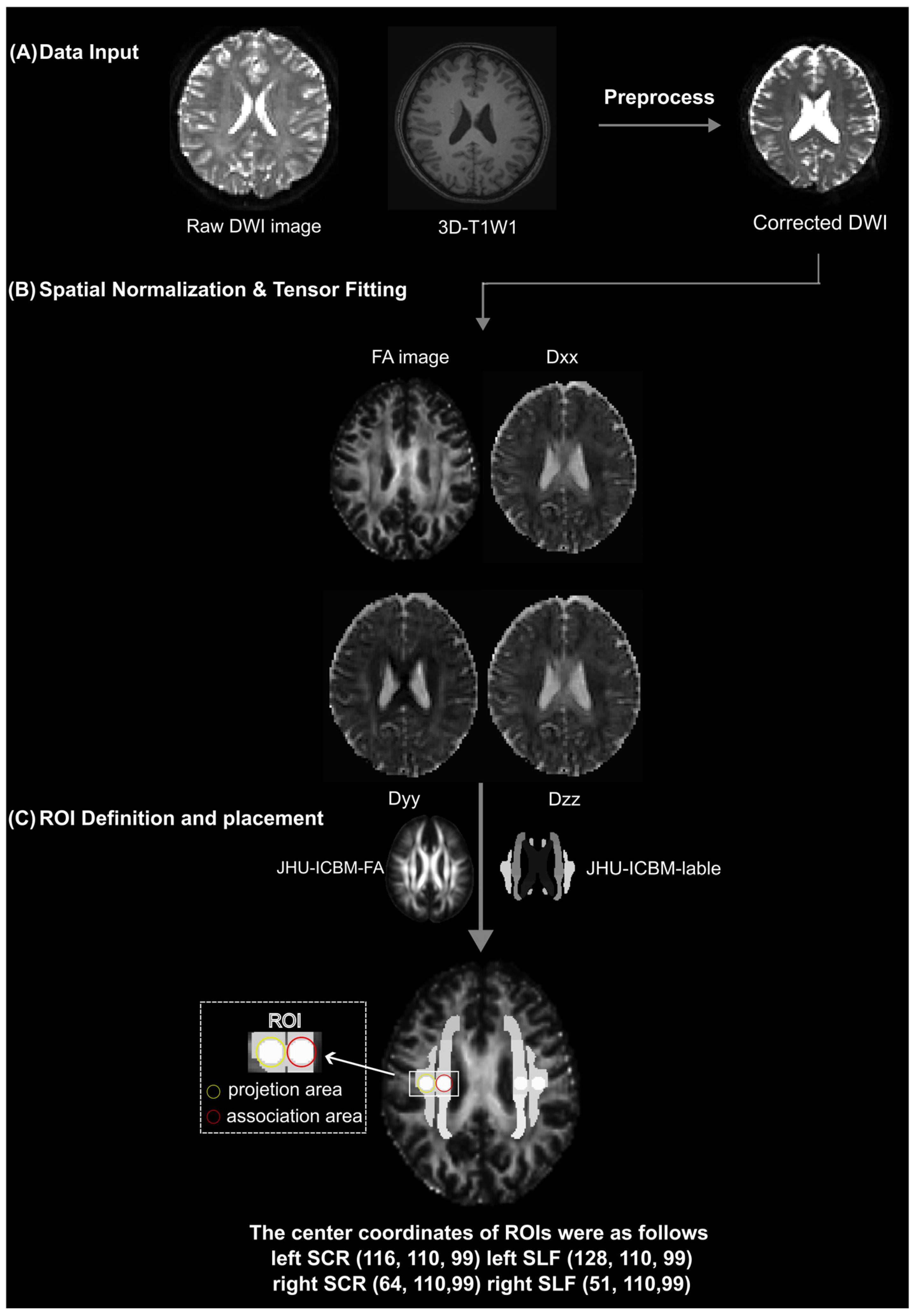 Individualized DTI-ALPS Identifies Phase-Specific Glymphatic ...