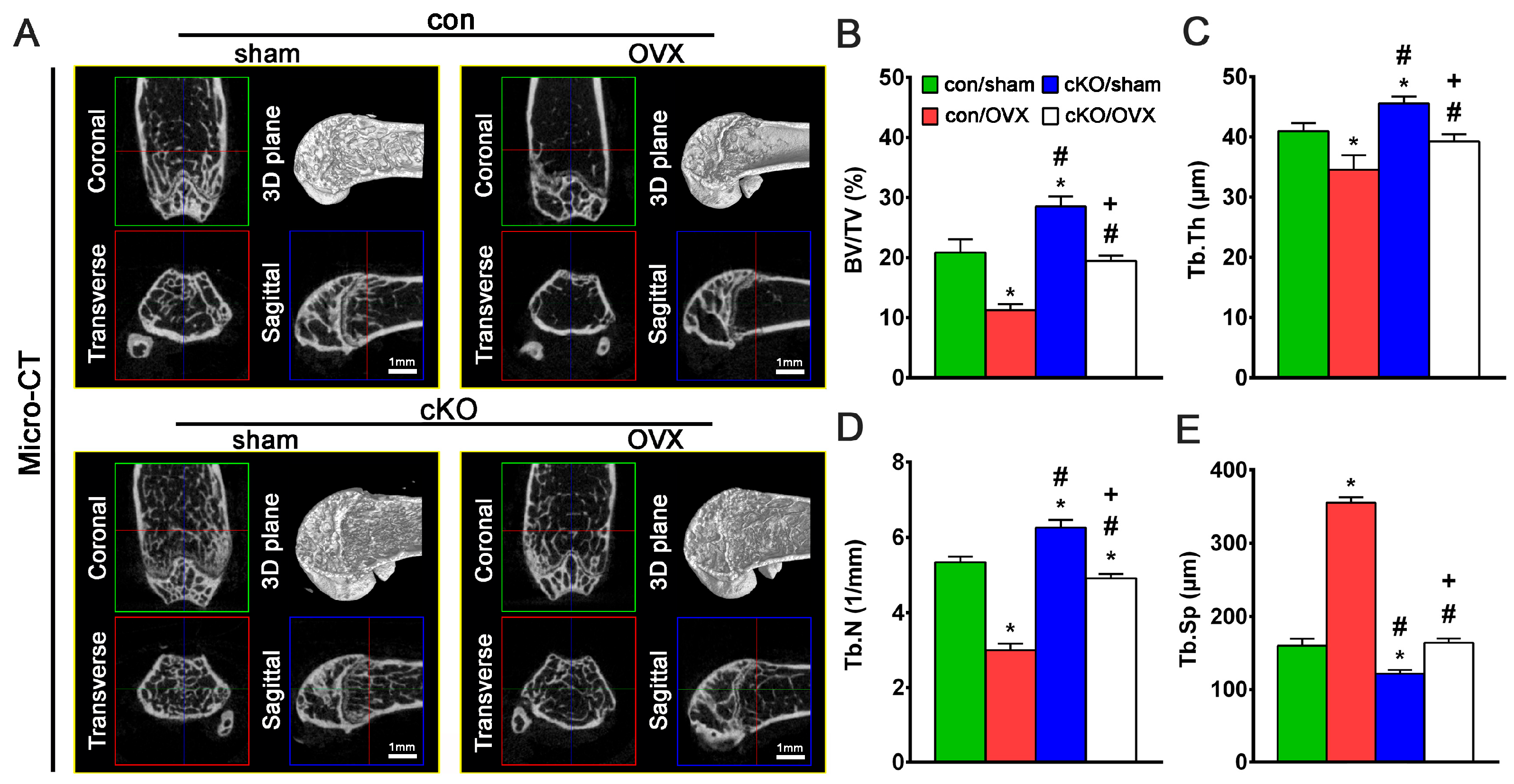 Myeloid-Specific Deletion of Lnx2 Attenuates Estrogen-Deficiency ...