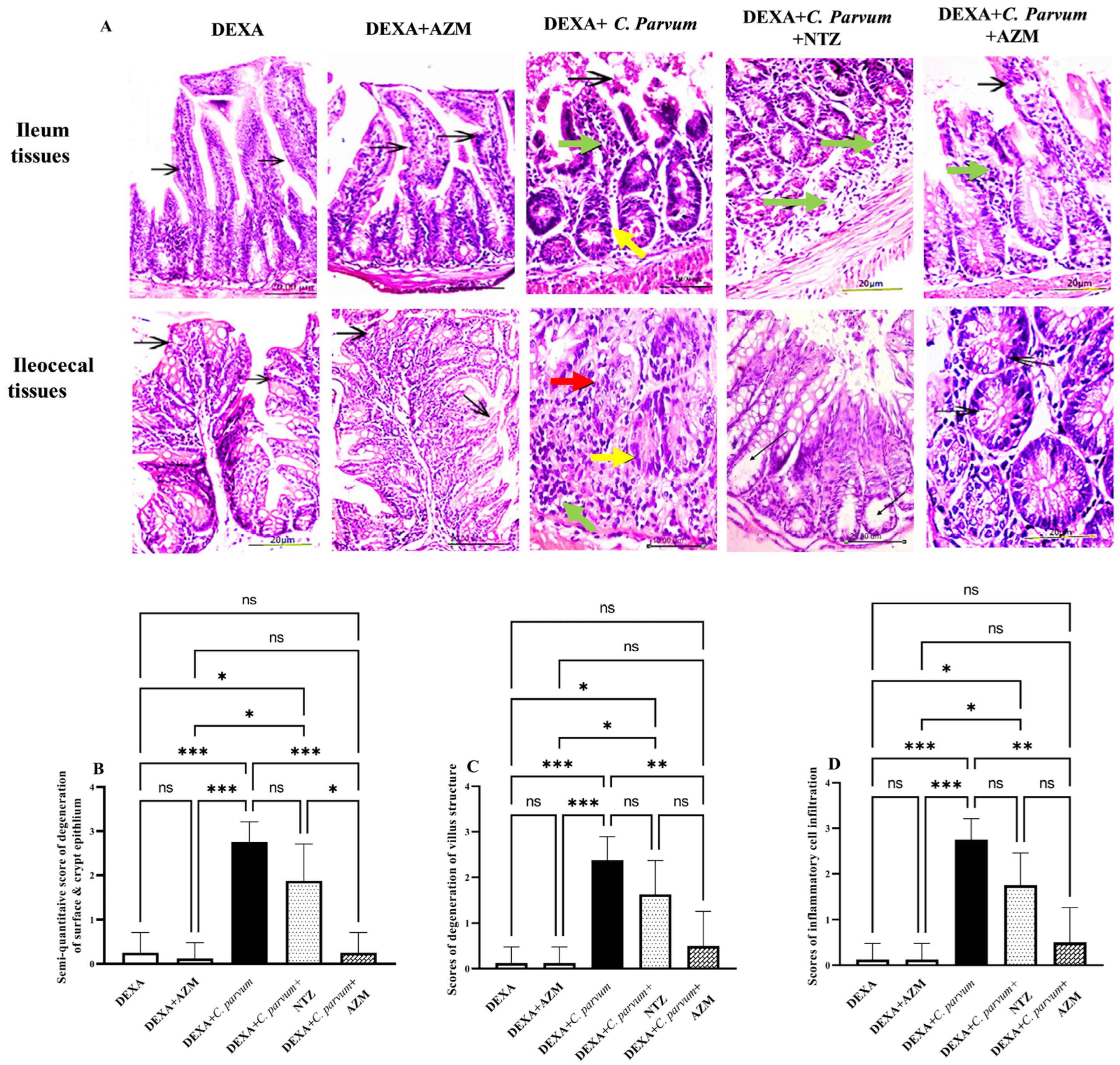 Azithromycin Mitigates Experimental Cryptosporidiosis-Driven Ileocecal ...