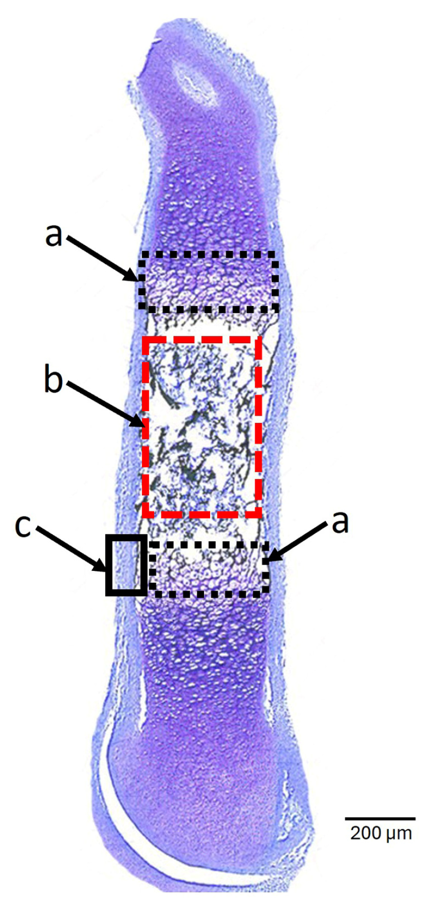Maternal Administration of Aripiprazole Impedes the Appendicular ...