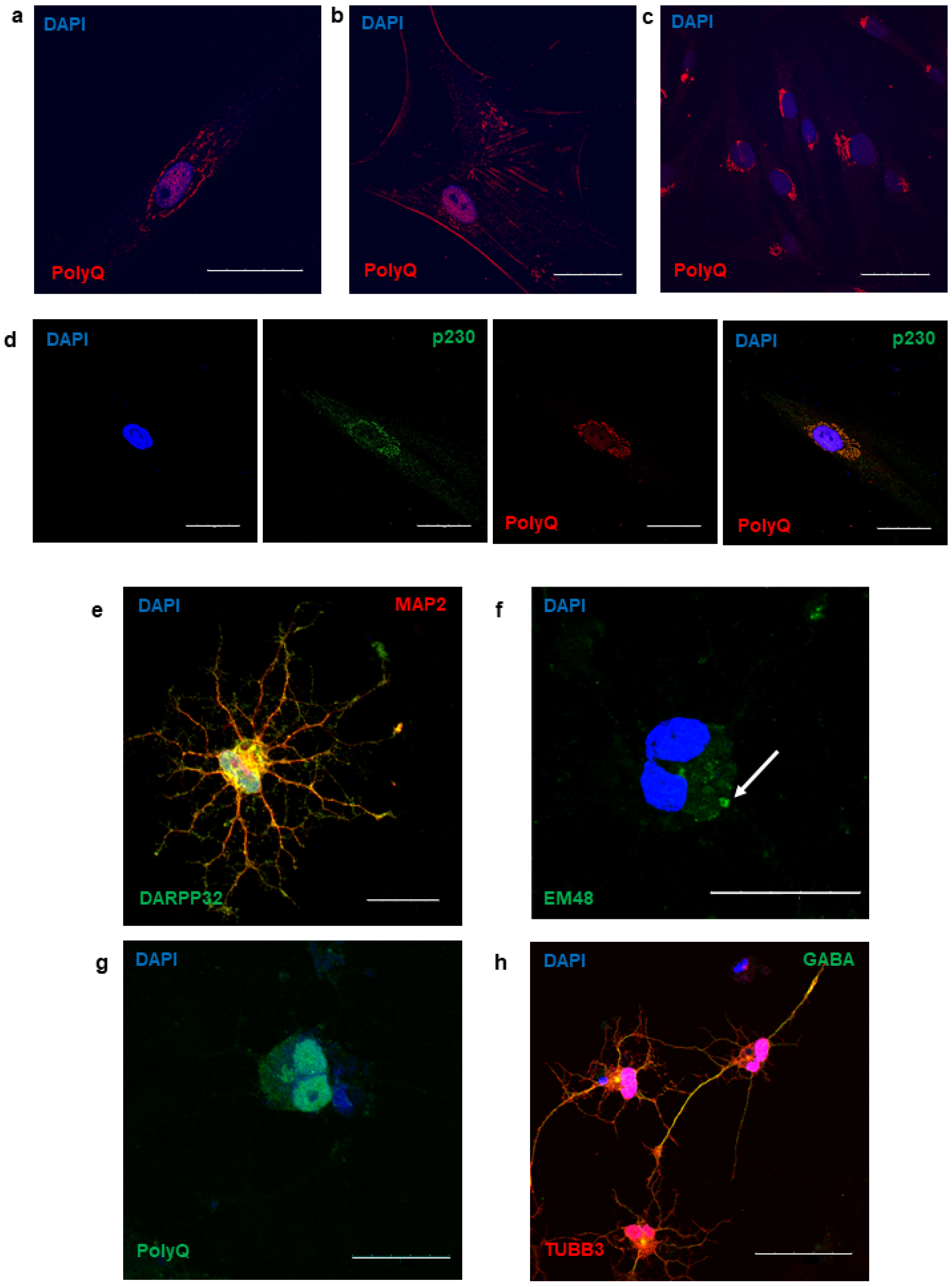 HDDF2—A Novel Patient-Derived Fibroblast Line from Huntington’s Disease ...