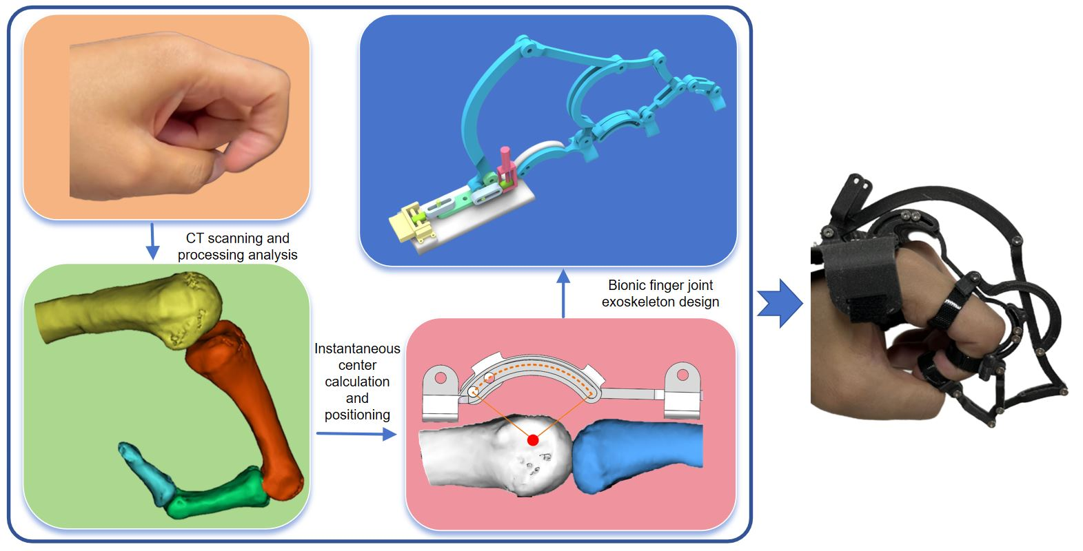 Medical Imaging-Based Kinematic Modeling for Biomimetic Finger Joints and Hand Exoskeleton ...