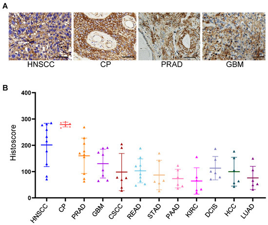 Evaluation of B7-H3 Targeted Immunotherapy in a 3D Organoid Model of ...