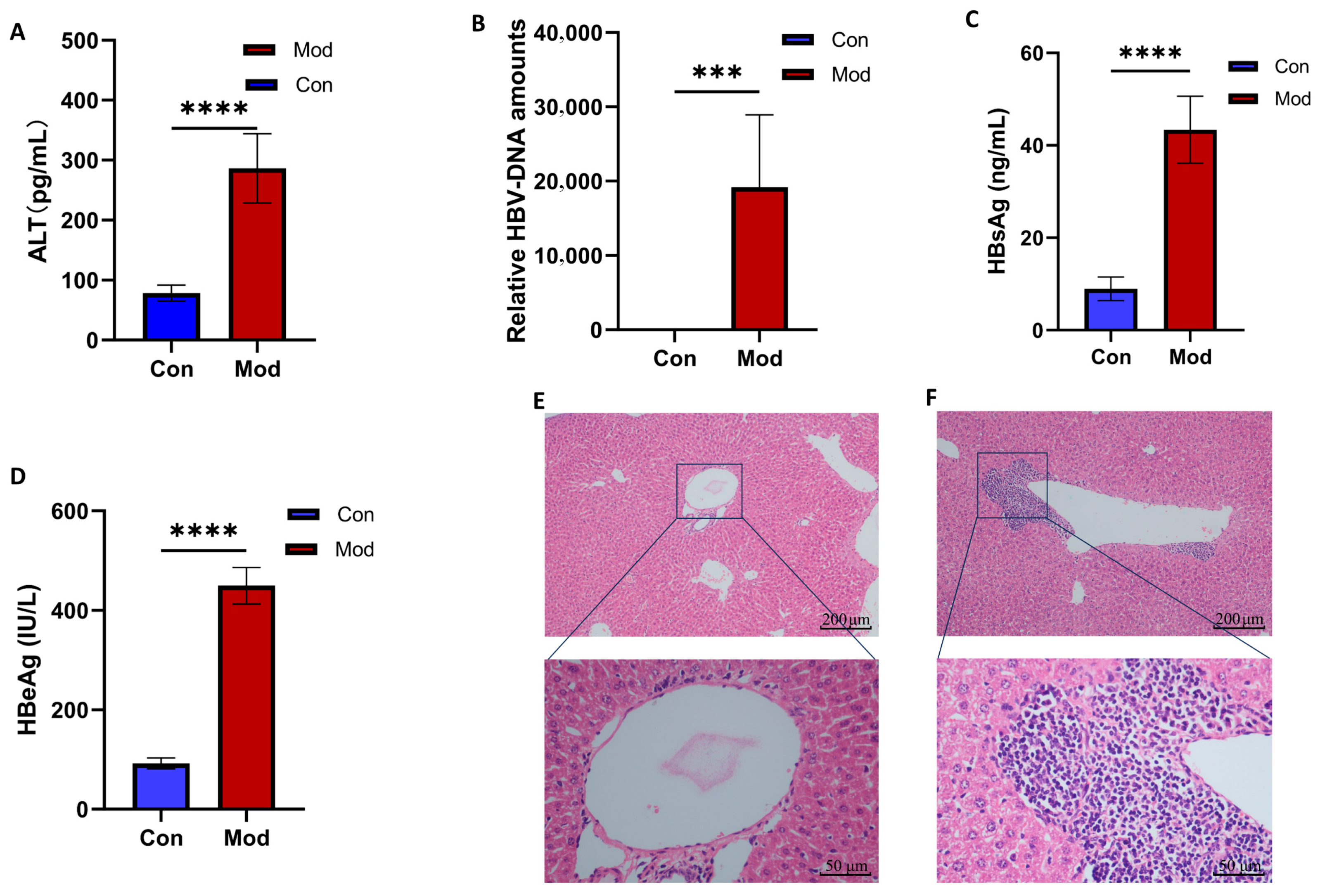 Molecular Network Analysis of HBV Persistent Infection from the ...