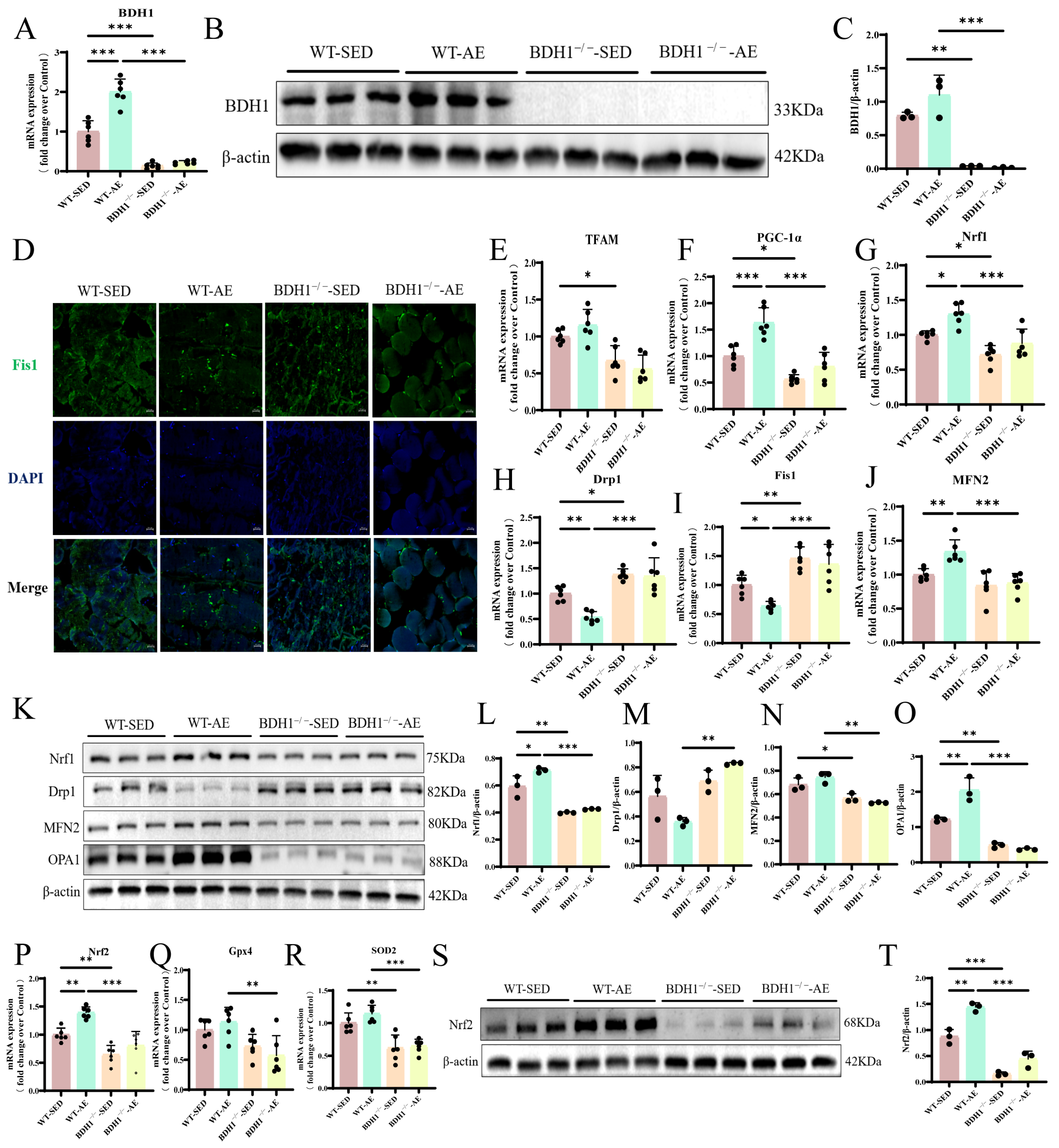 BDH1 Mediates Aerobic Exercise-Induced Improvement in Skeletal Muscle ...