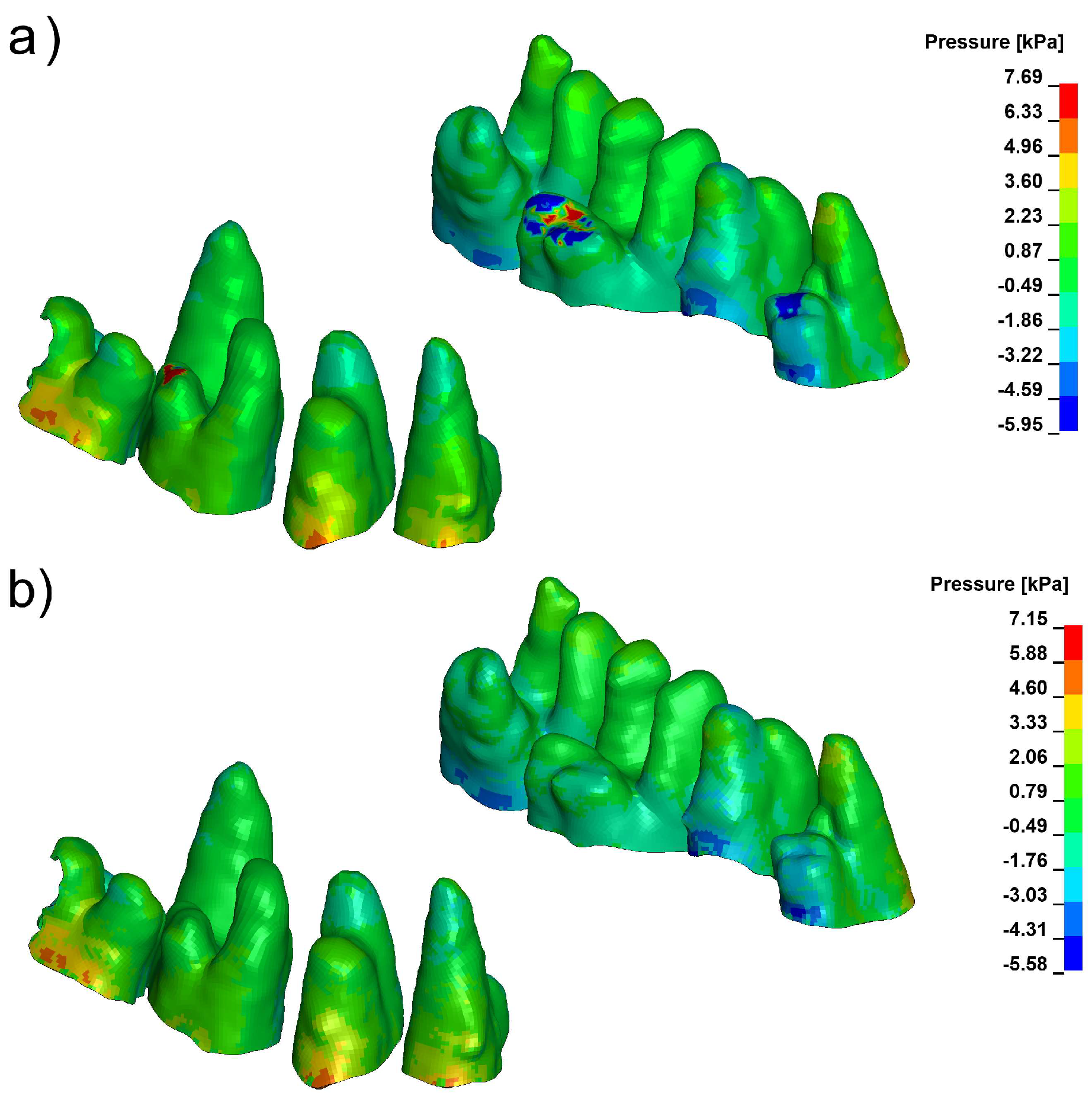 Mechanobiological Regulation of Alveolar Bone Remodeling: A Finite ...