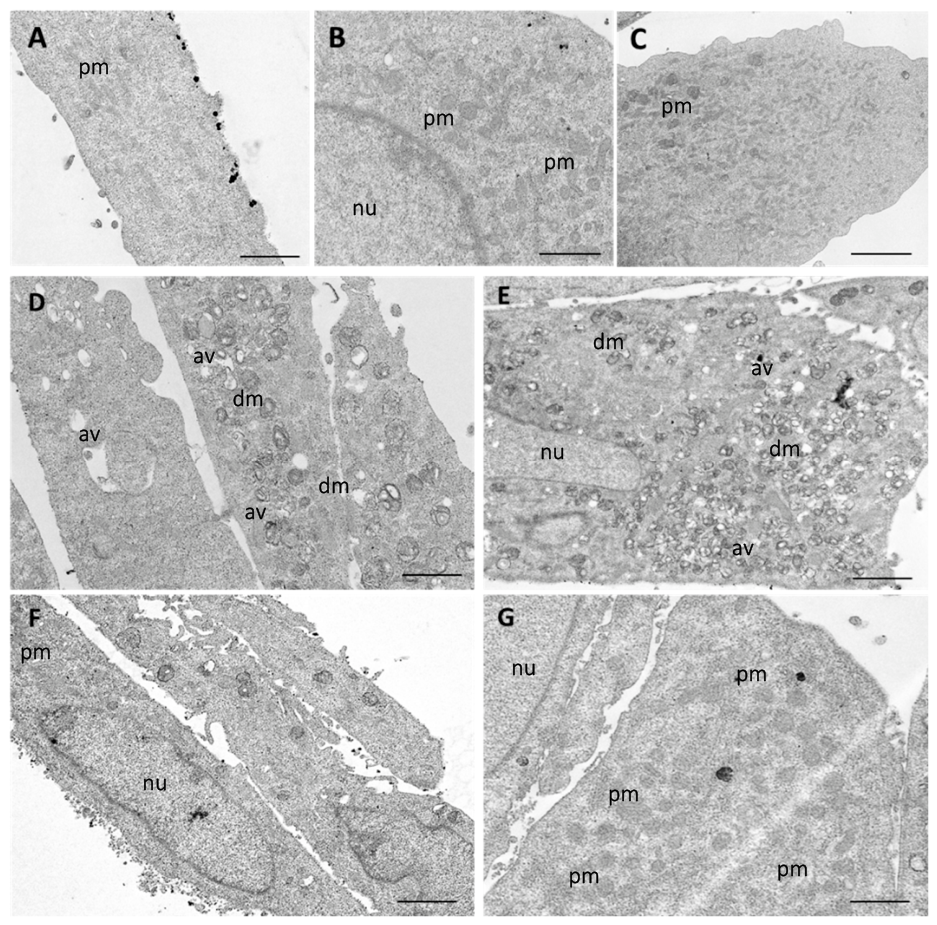 Revitalizing Muscle Repair: Hyaluronan Preserves Mitochondrial ...