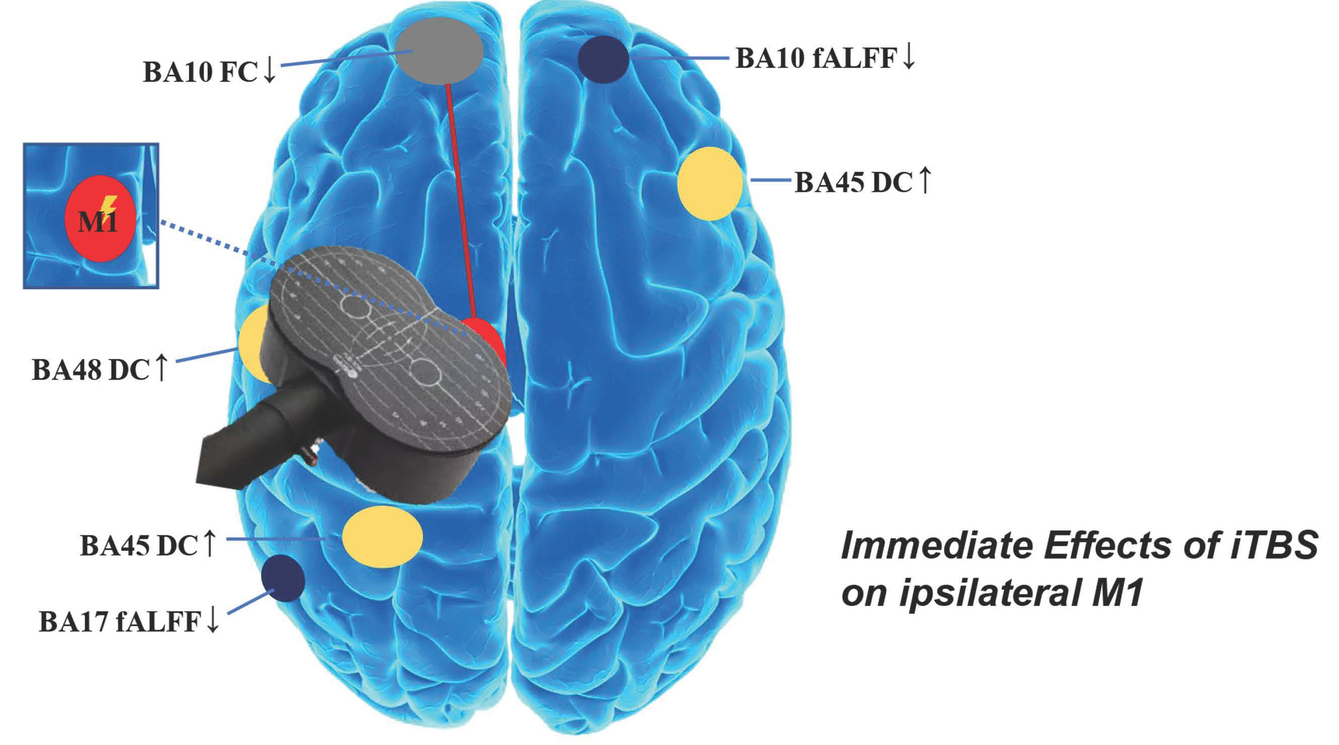 Capturing Neuroplastic Changes after iTBS in Patients with Post-Stroke ...