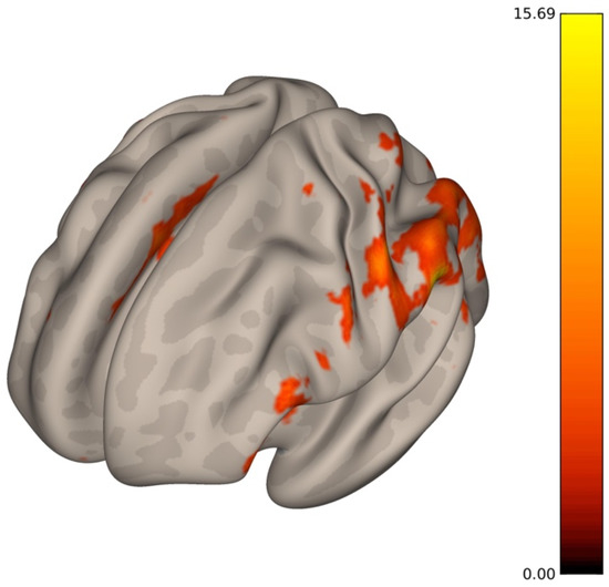 Brain Sciences | Free Full-Text | Resting-State Functional Magnetic ...