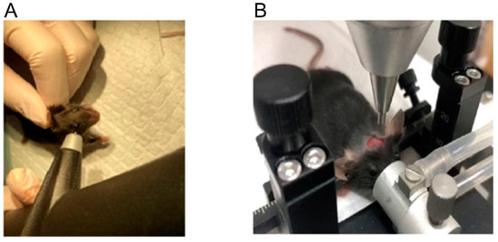 mTBI-Induced Systemic Vascular Dysfunction in a Mouse mTBI Model