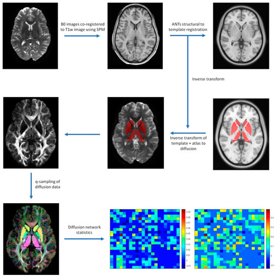 Diffusion Measures of Subcortical Structures Using High-Field MRI