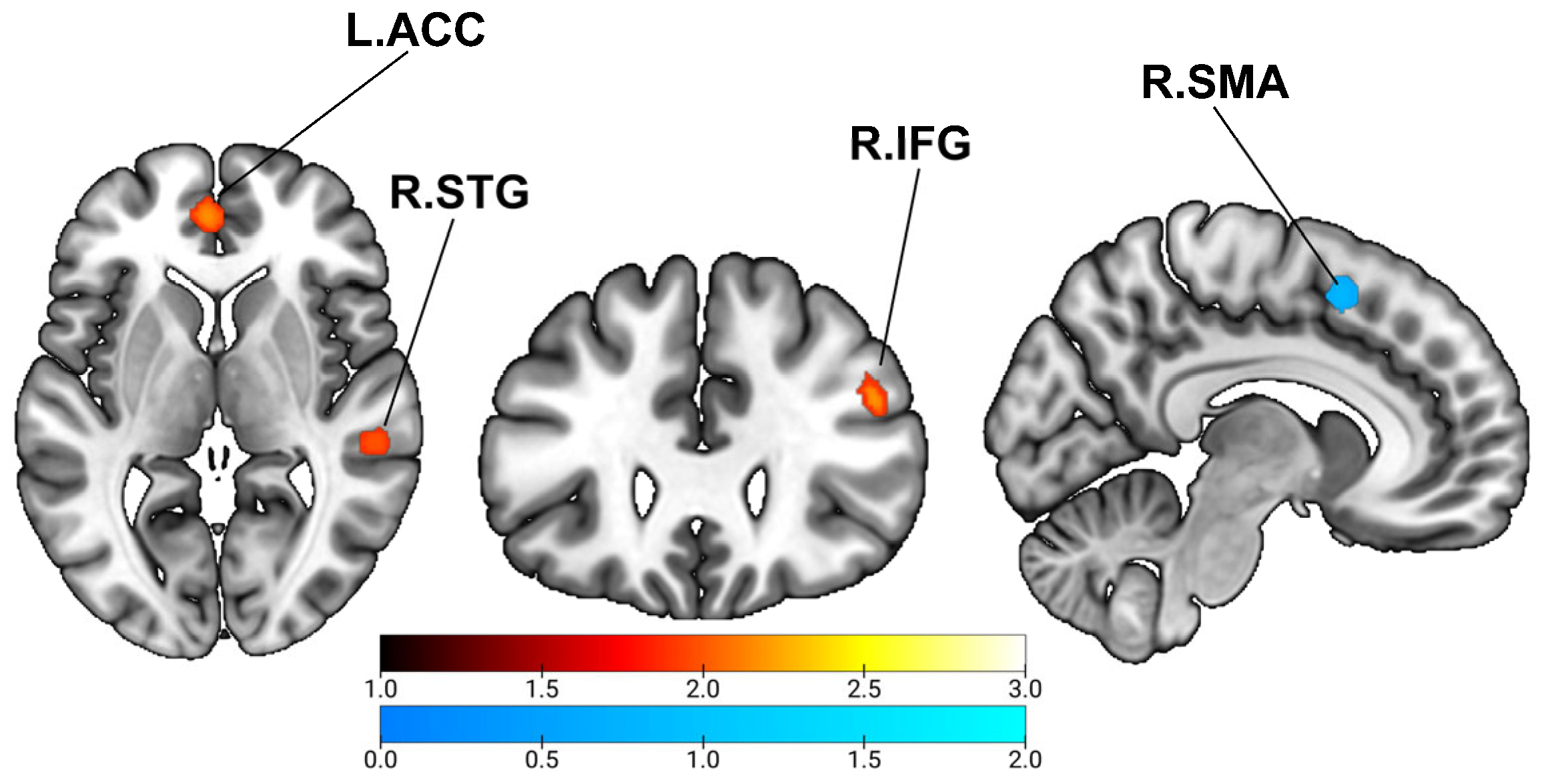 Neural Correlates of Cognitive Gains Induced by Commercially Available ...