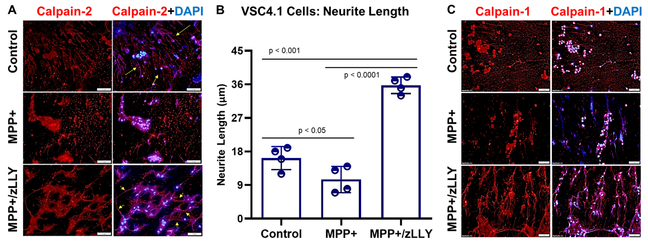 Calpain-2 Regulates Kinesin and Dynein Dysfunction in Neurotoxin ...
