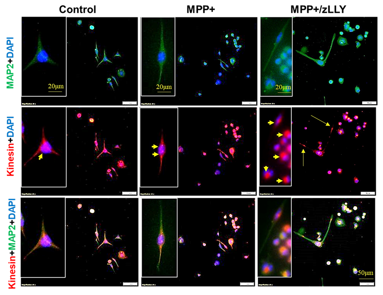 Calpain-2 Regulates Kinesin and Dynein Dysfunction in Neurotoxin ...
