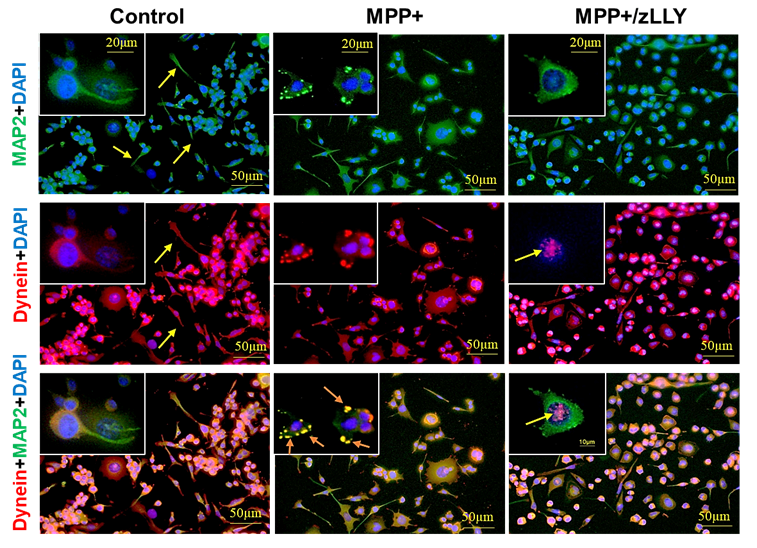 Calpain-2 Regulates Kinesin and Dynein Dysfunction in Neurotoxin ...