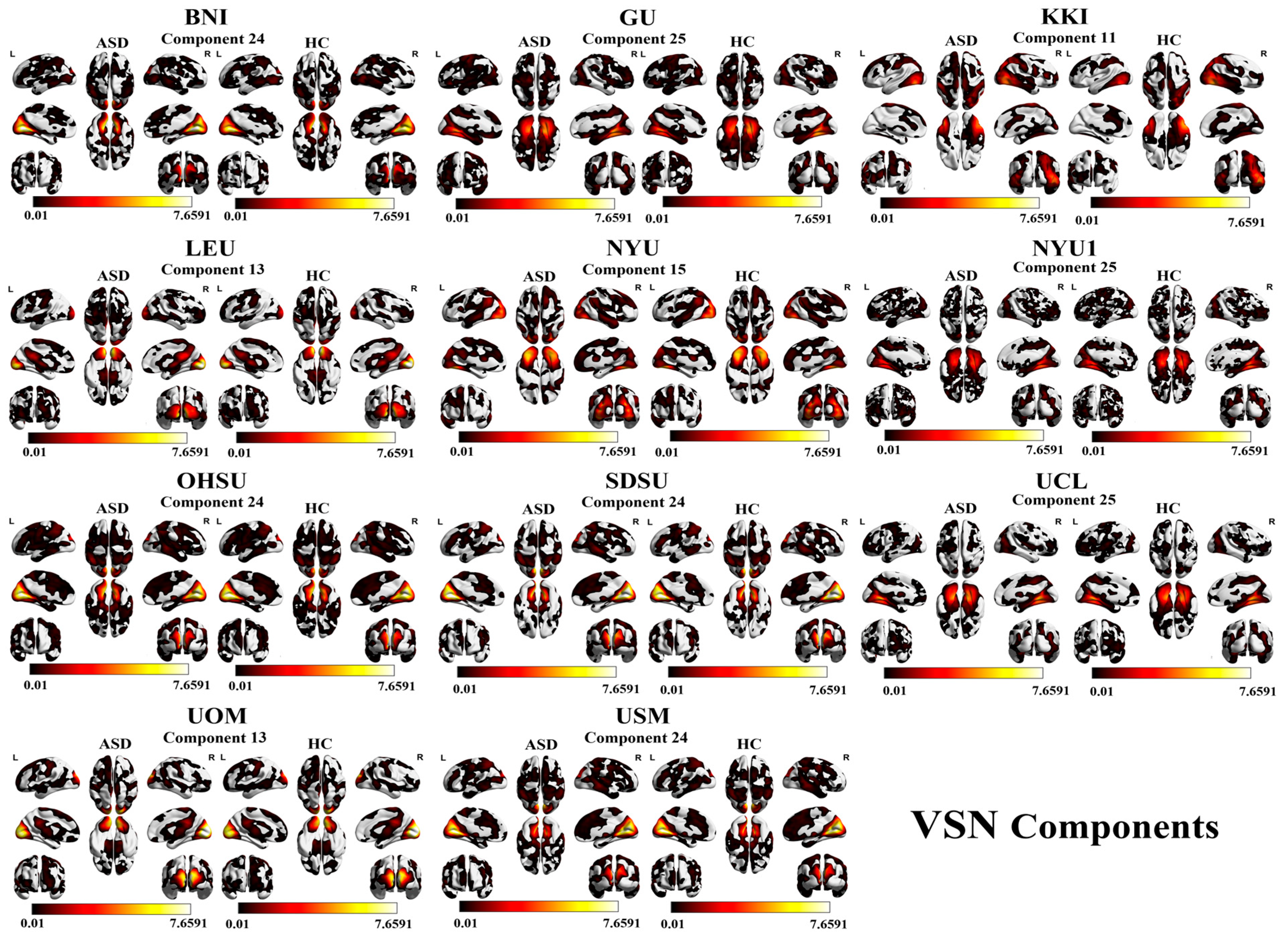Multi-Site Classification of Autism Spectrum Disorder Using Spatially ...