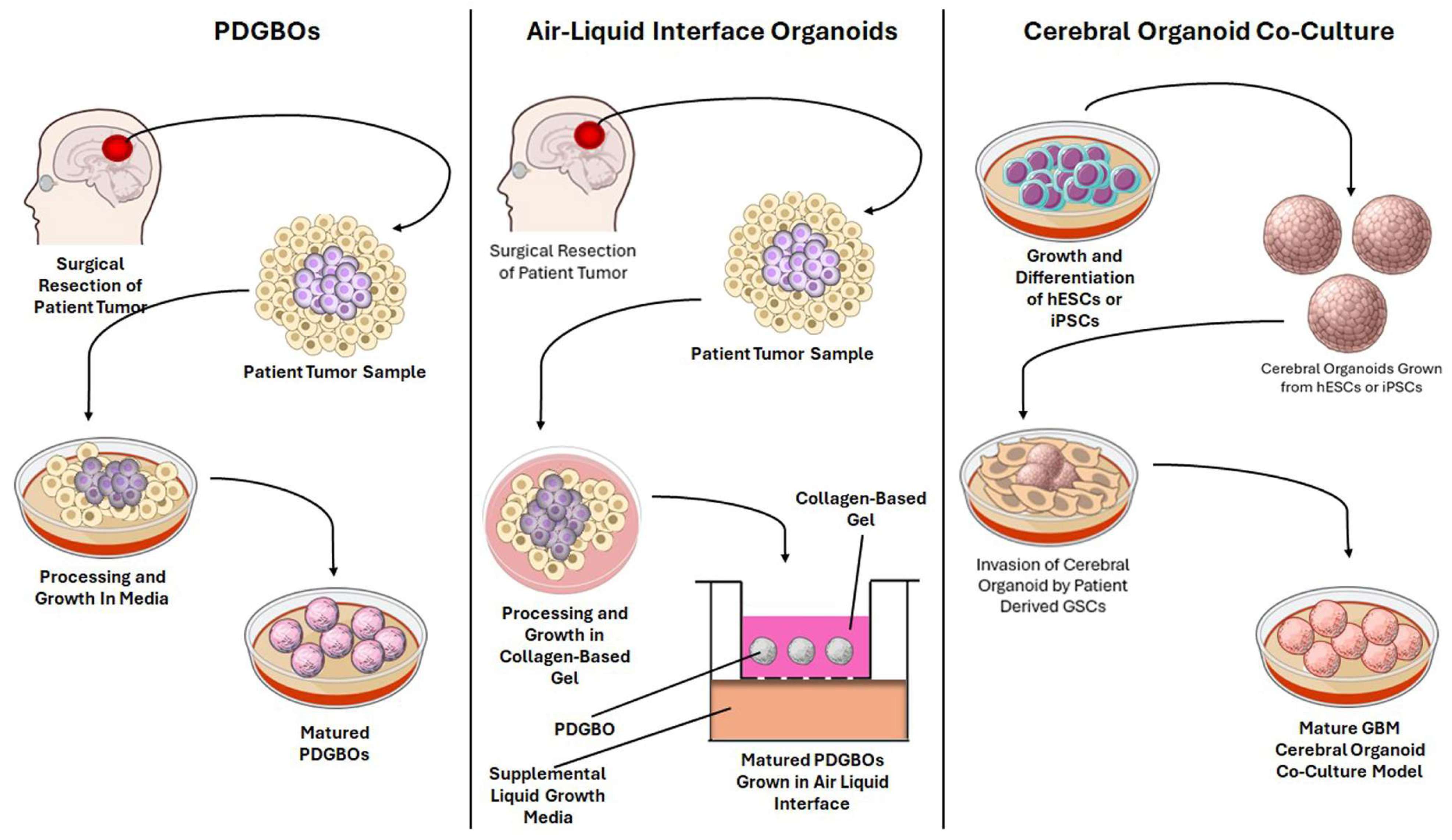 Organoids to Model Tumor Microenvironment in Progression of ...