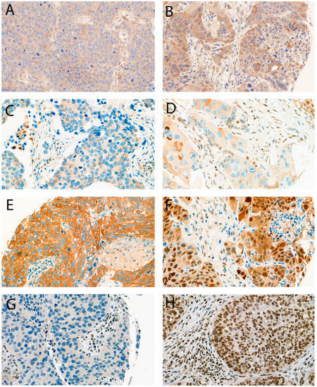 Expression Analysis of Autophagy Related Markers LC3B, p62 and HMGB1 ...