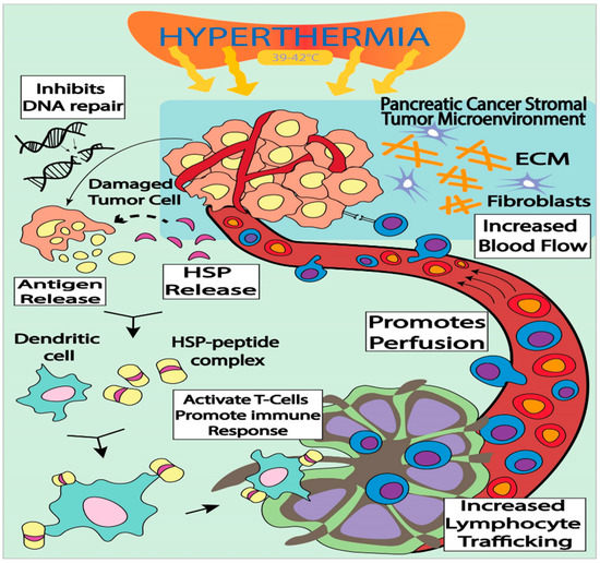 Immunotherapy, Radiotherapy, and Hyperthermia: A Combined Therapeutic ...
