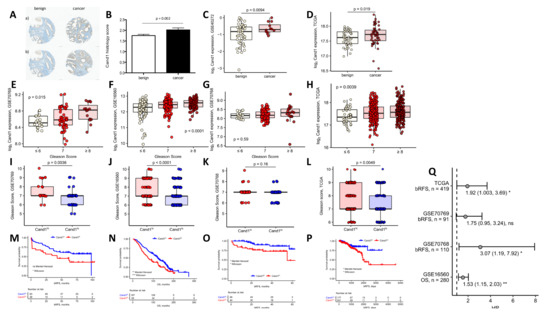 The Impact of Cand1 in Prostate Cancer