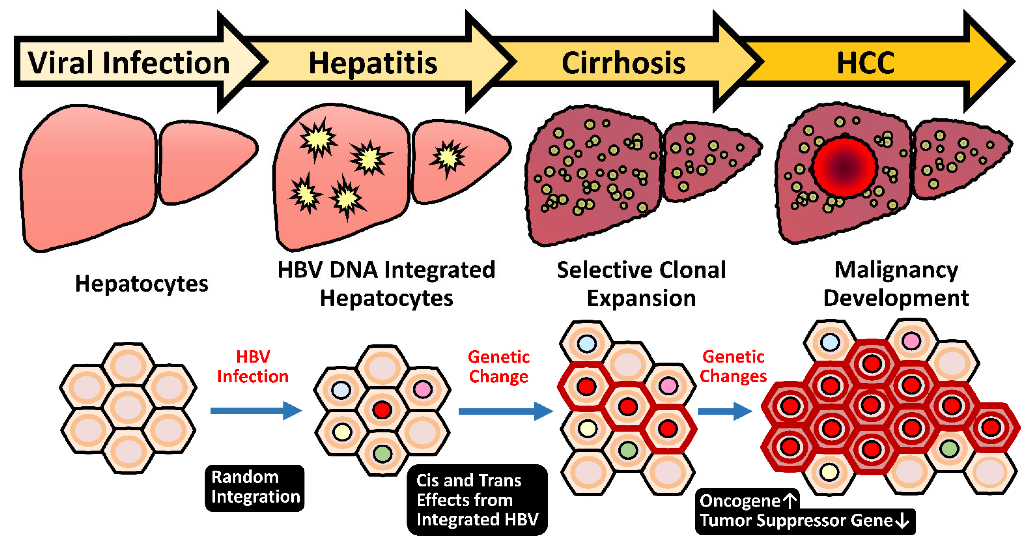 Cancers Free Full Text Unique Features Of Hepatitis B Virus Related Cancers Free Full Text Unique Features Of Hepatitis B Virus Related