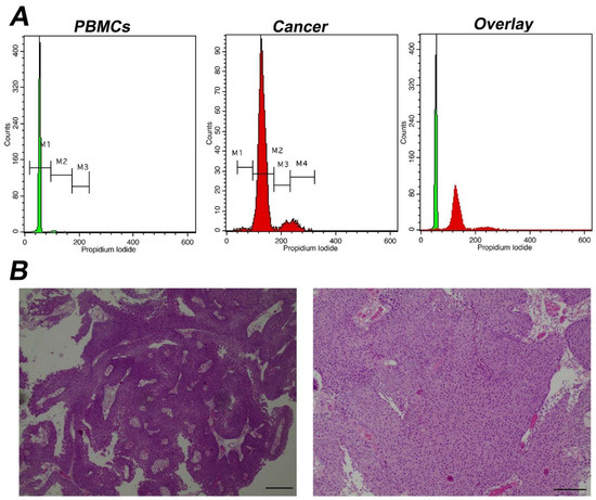 Accurate Characterization of Bladder Cancer Cells with Intraoperative ...