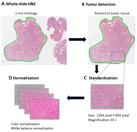 AI Deployment on GBM Diagnosis: A Novel Approach to Analyze Histopathological Images Using Image ...