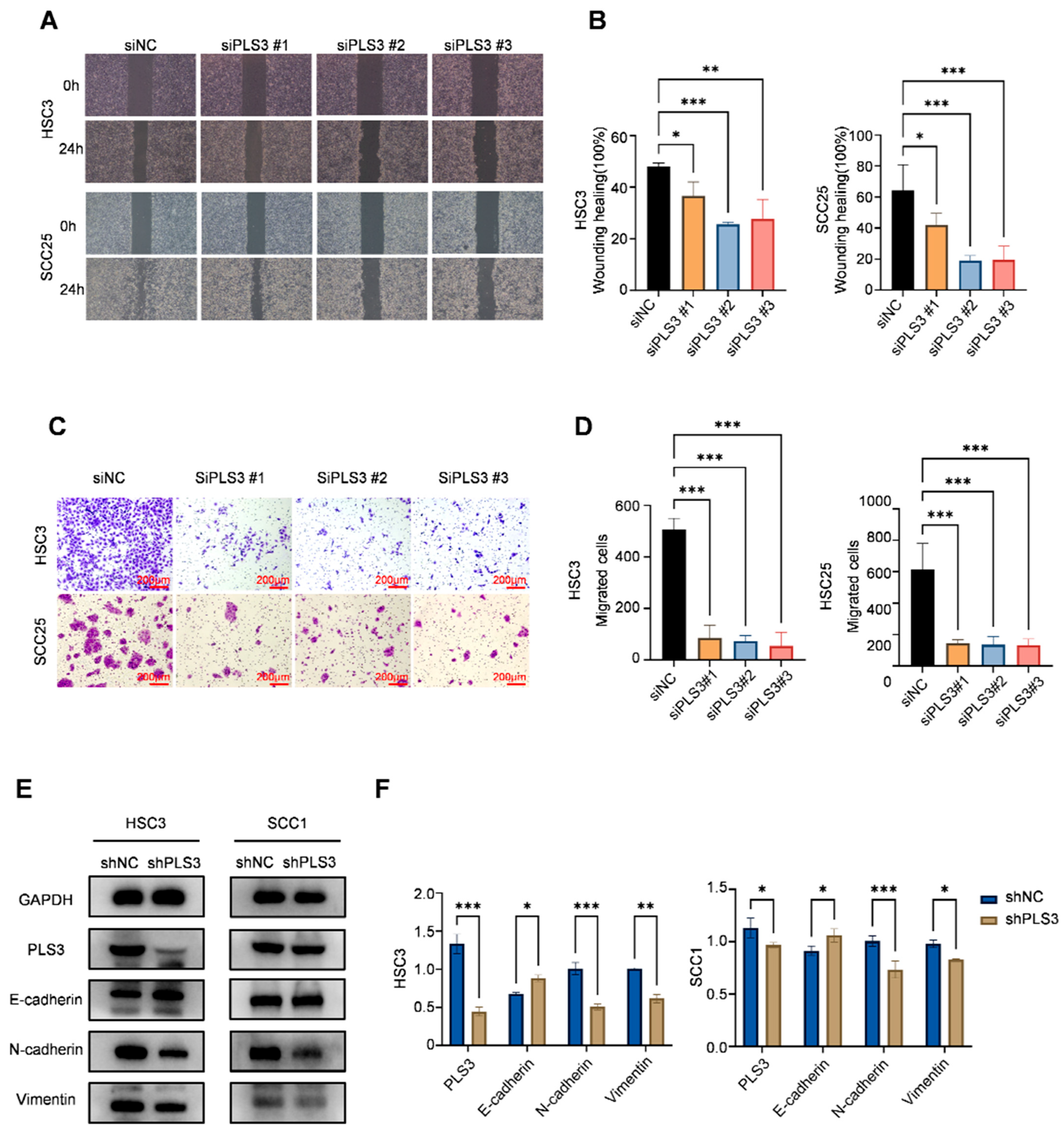 PLS3 Is a Prognostic Biomarker and Correlates with Immune Infiltrates ...