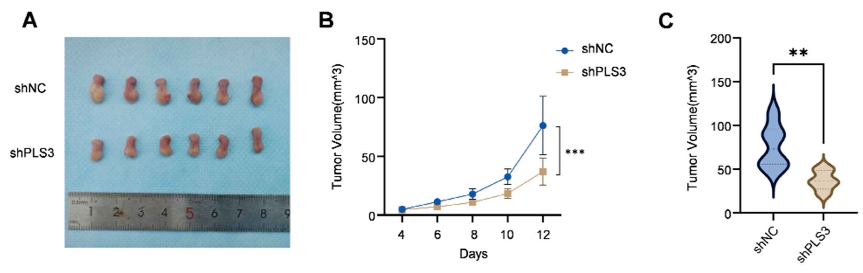 PLS3 Is a Prognostic Biomarker and Correlates with Immune Infiltrates ...