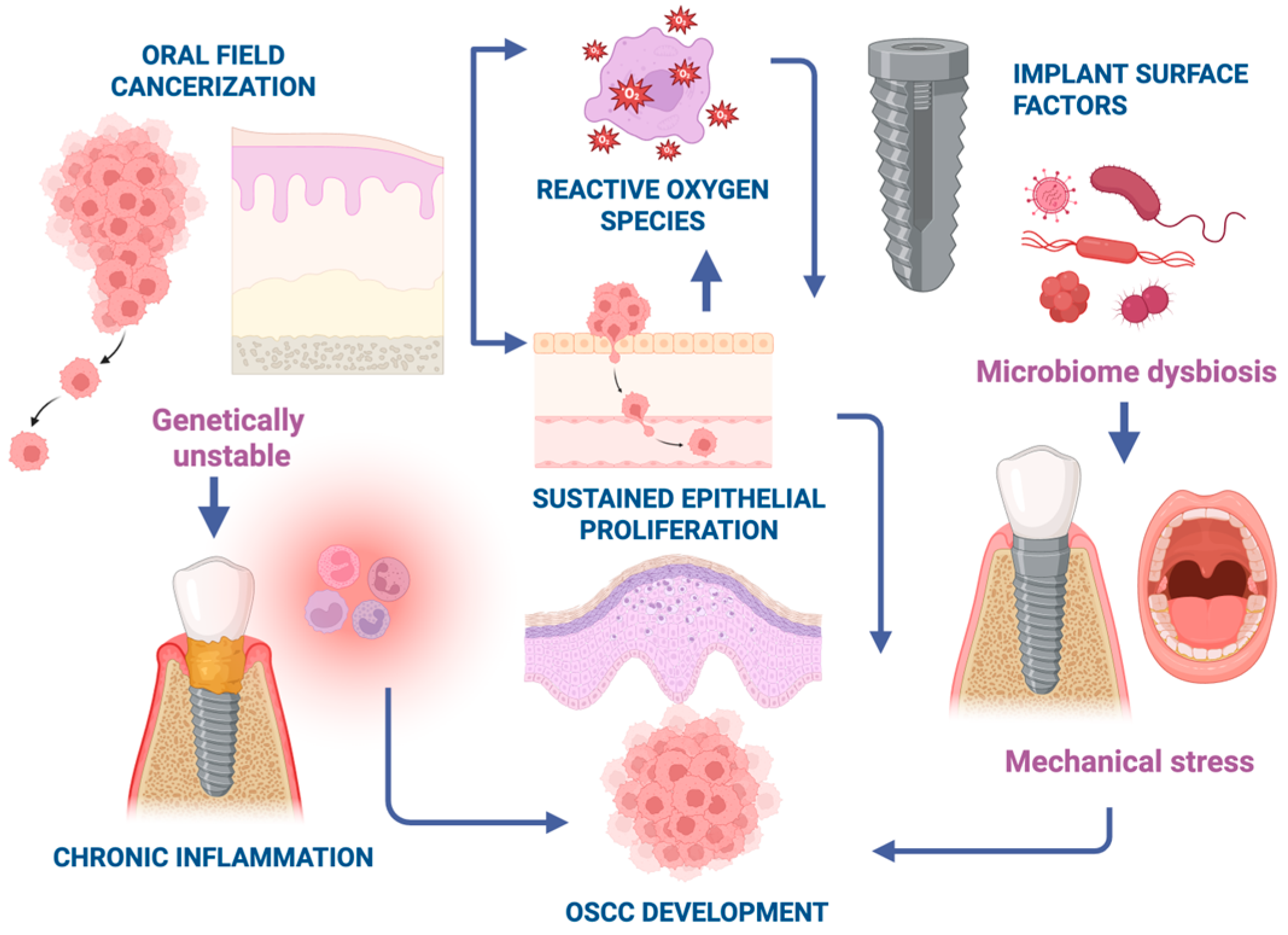 Oral Squamous Cell Carcinoma Associated with Dental Implants: A ...