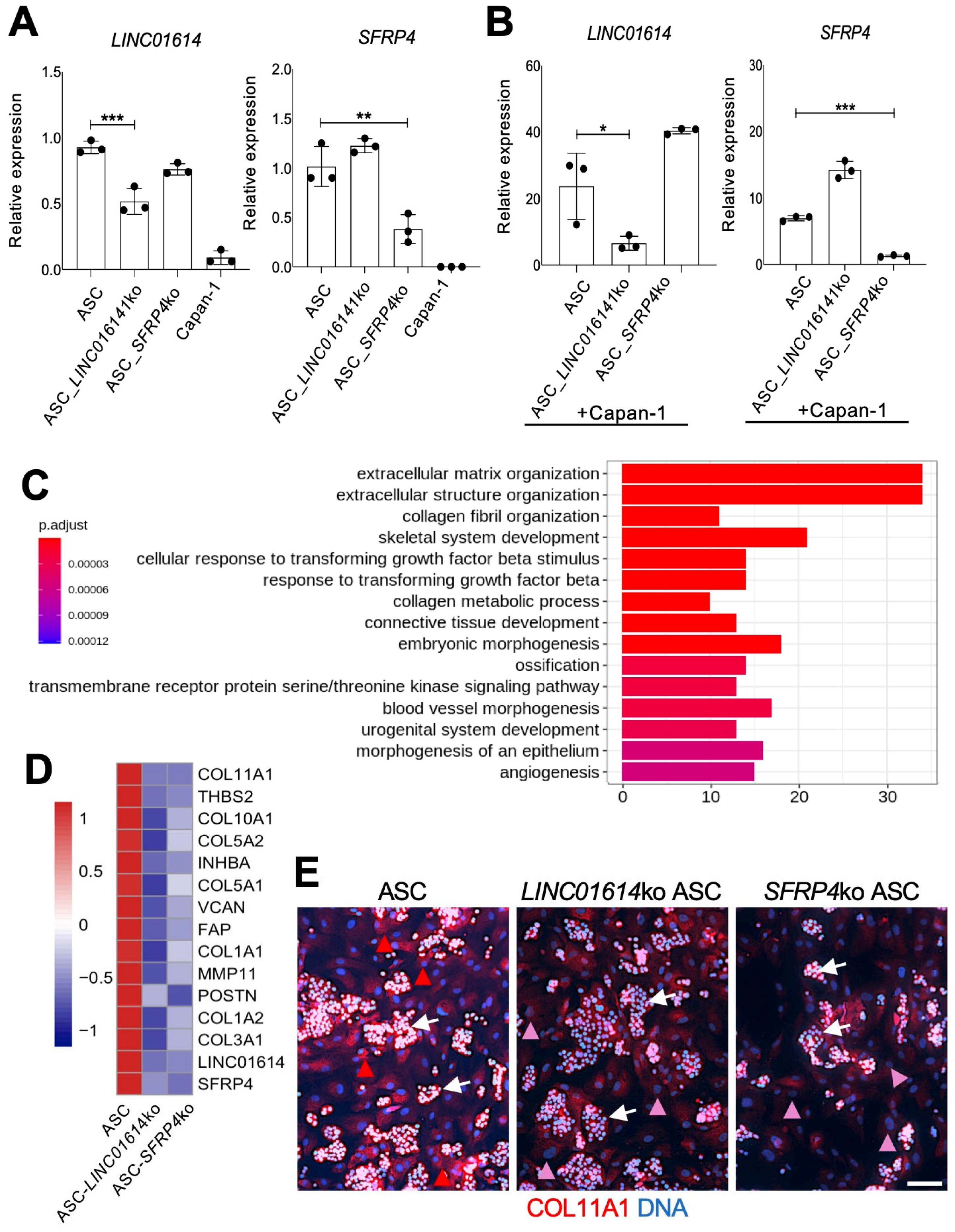 Adipose Stromal Cell-Derived Cancer-Associated Fibroblasts Promote ...
