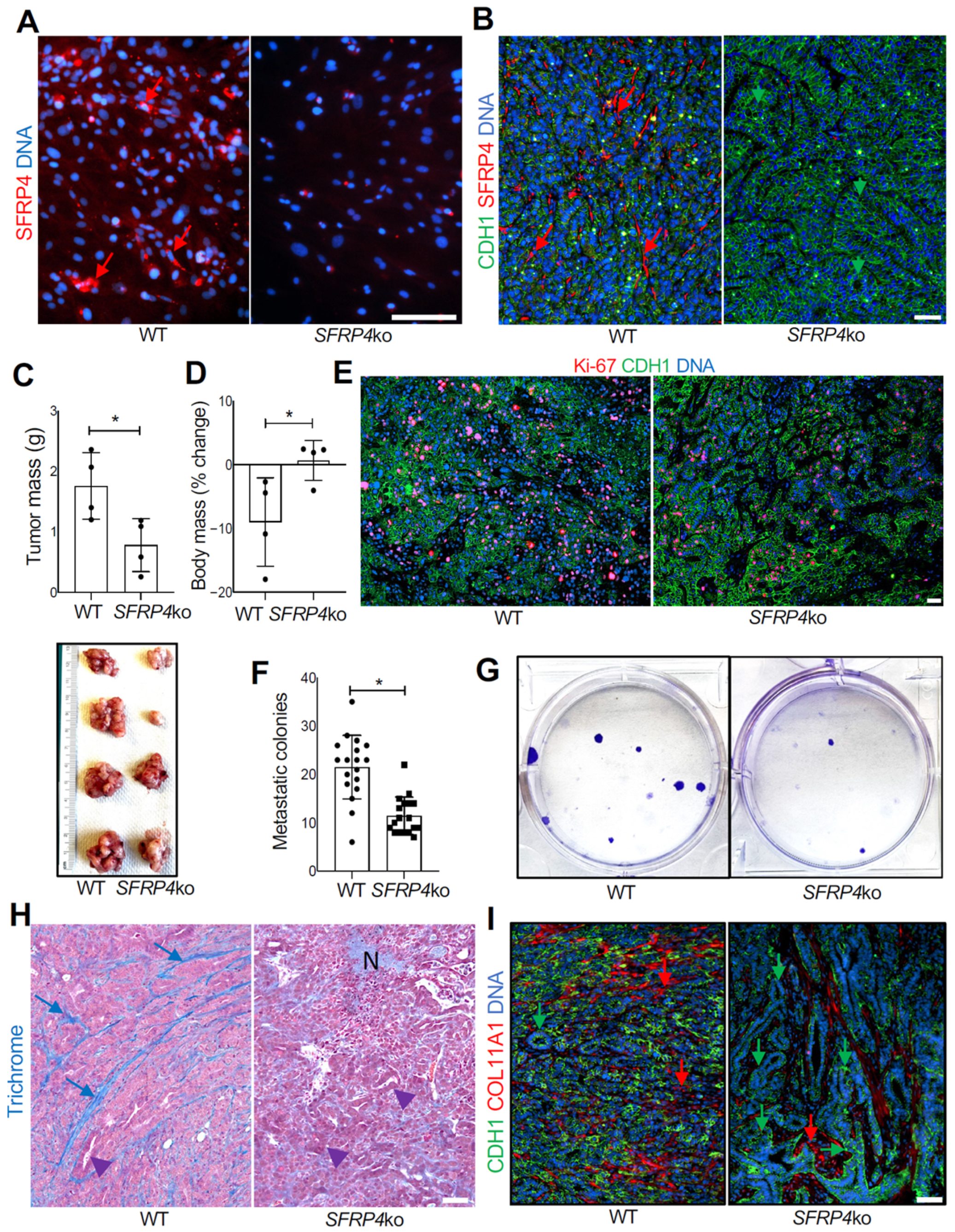 Adipose Stromal Cell-Derived Cancer-Associated Fibroblasts Promote ...