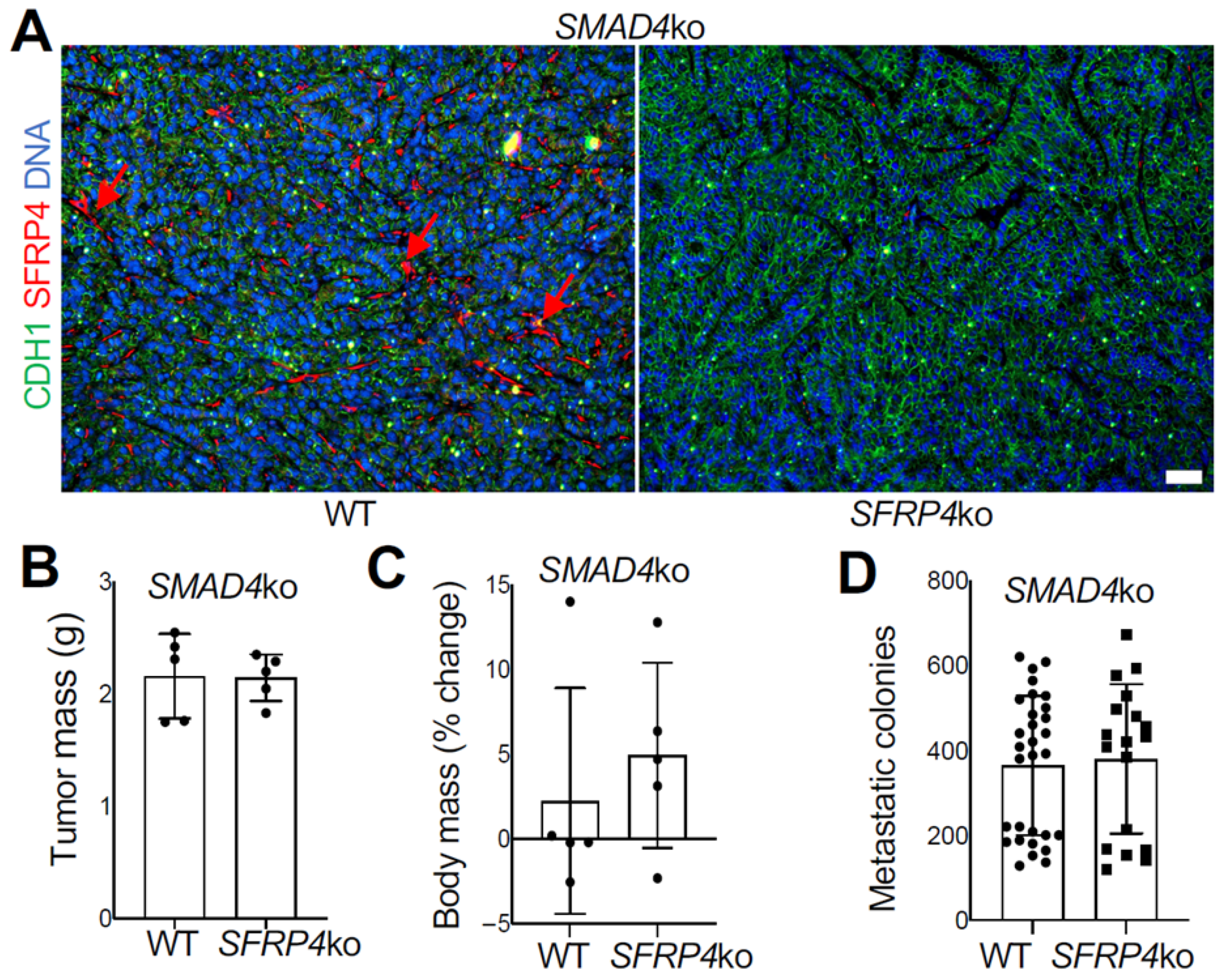 Adipose Stromal Cell-Derived Cancer-Associated Fibroblasts Promote ...