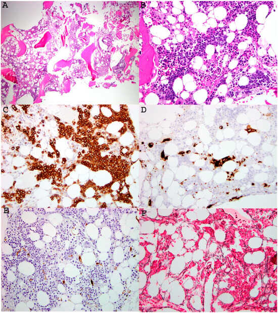 Cancers | January-2 2026 - Browse Articles