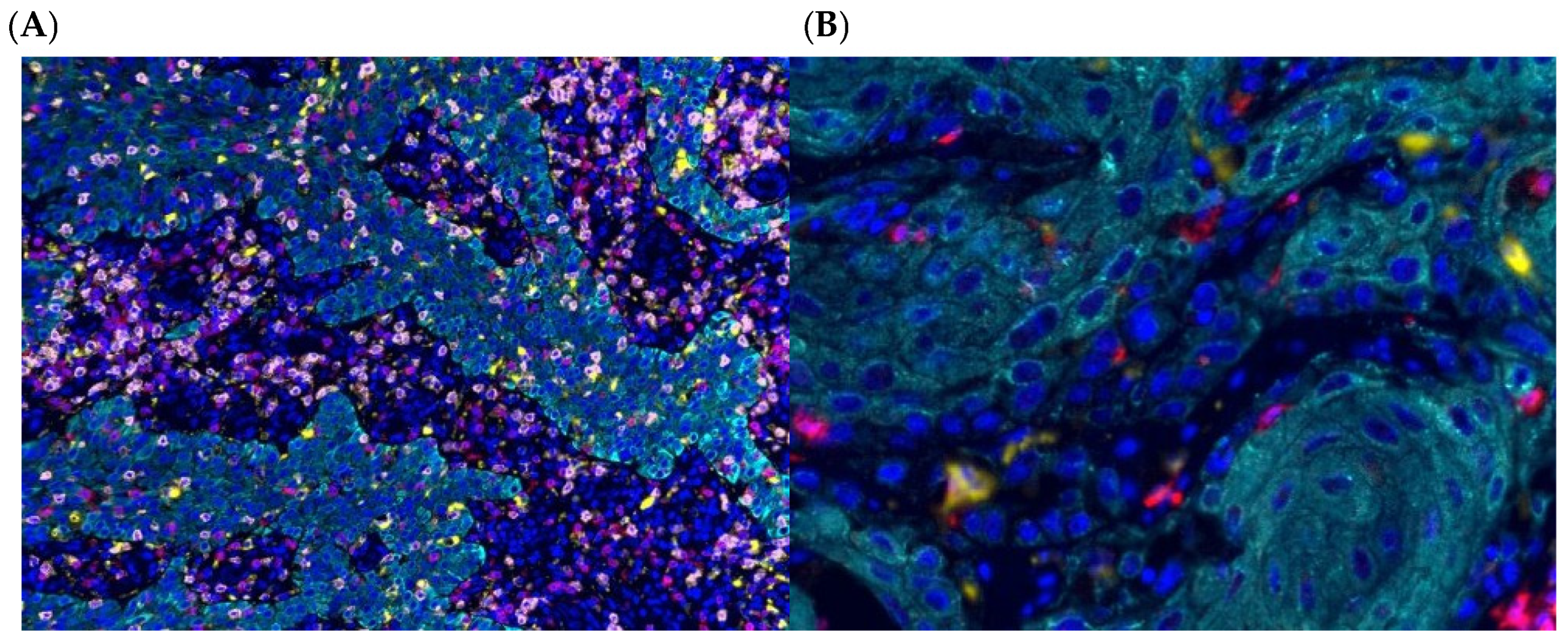 Geospatial and Cell Density Analysis Using Multiplex Immunofluorescence ...