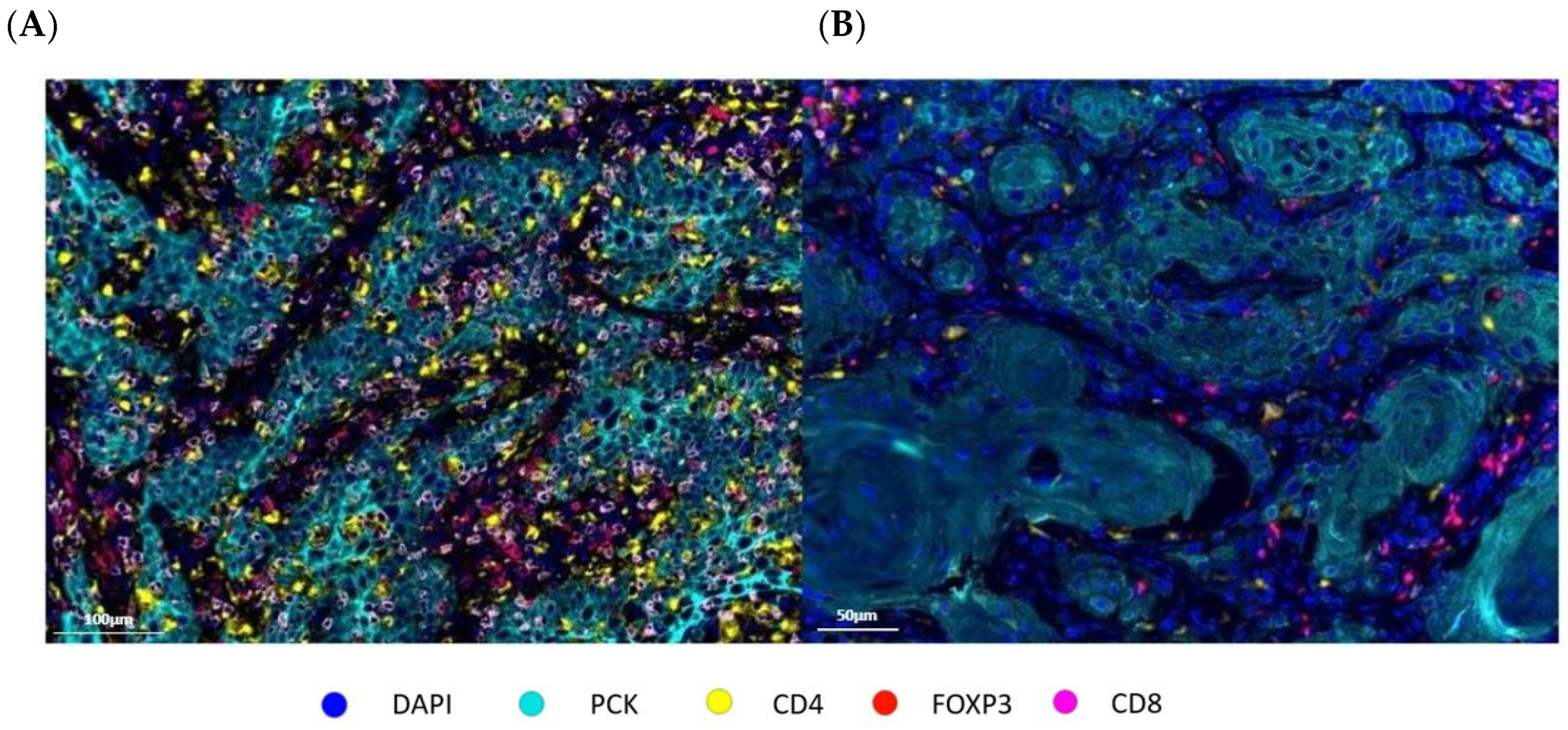 Geospatial and Cell Density Analysis Using Multiplex Immunofluorescence ...