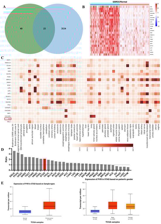 Poliovirus Receptor as a Potential Target in Gastric Signet-Ring Cell ...