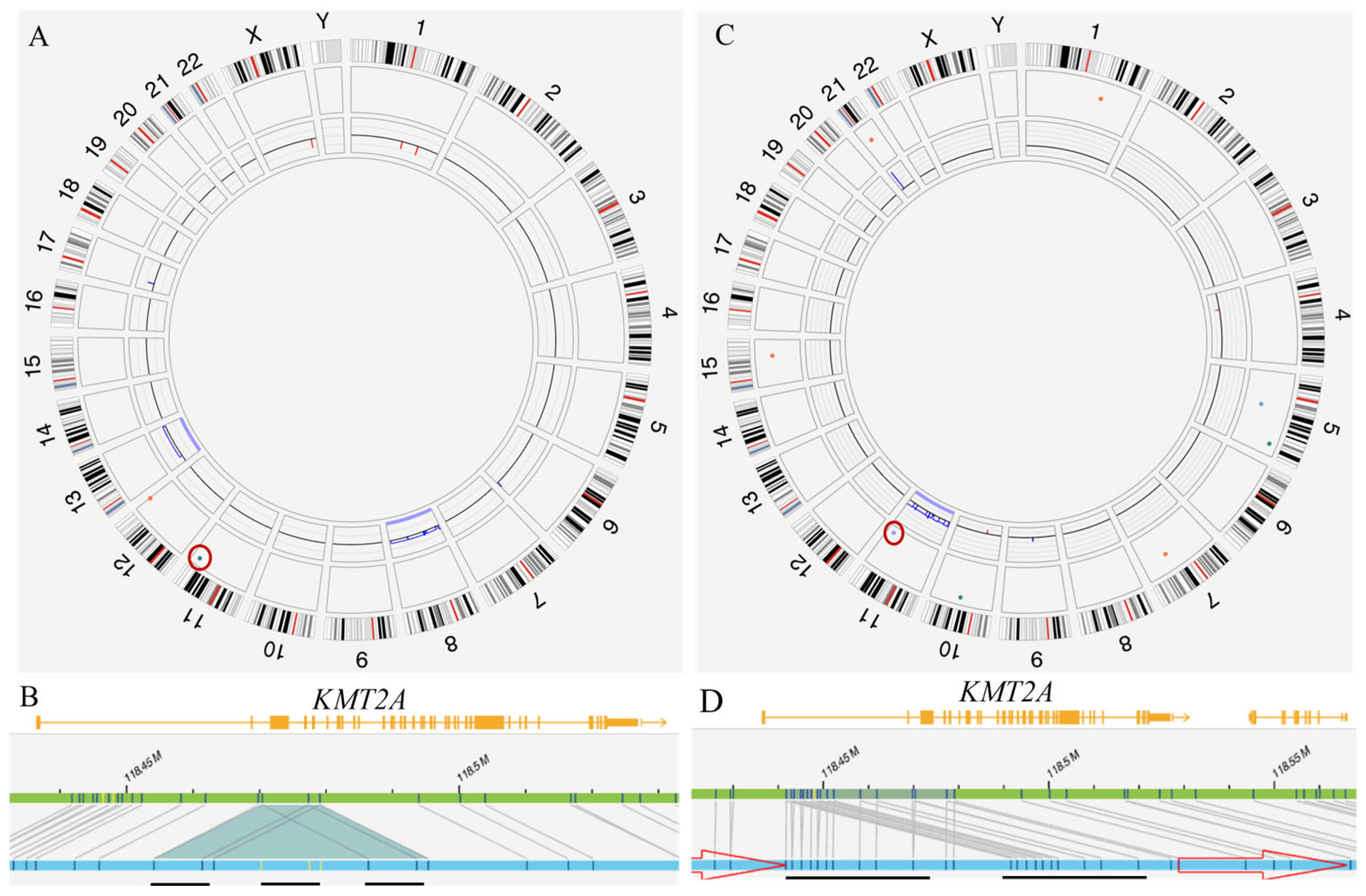 Aberrant CD25 and Increased CD123 Expression Are Common in Acute ...