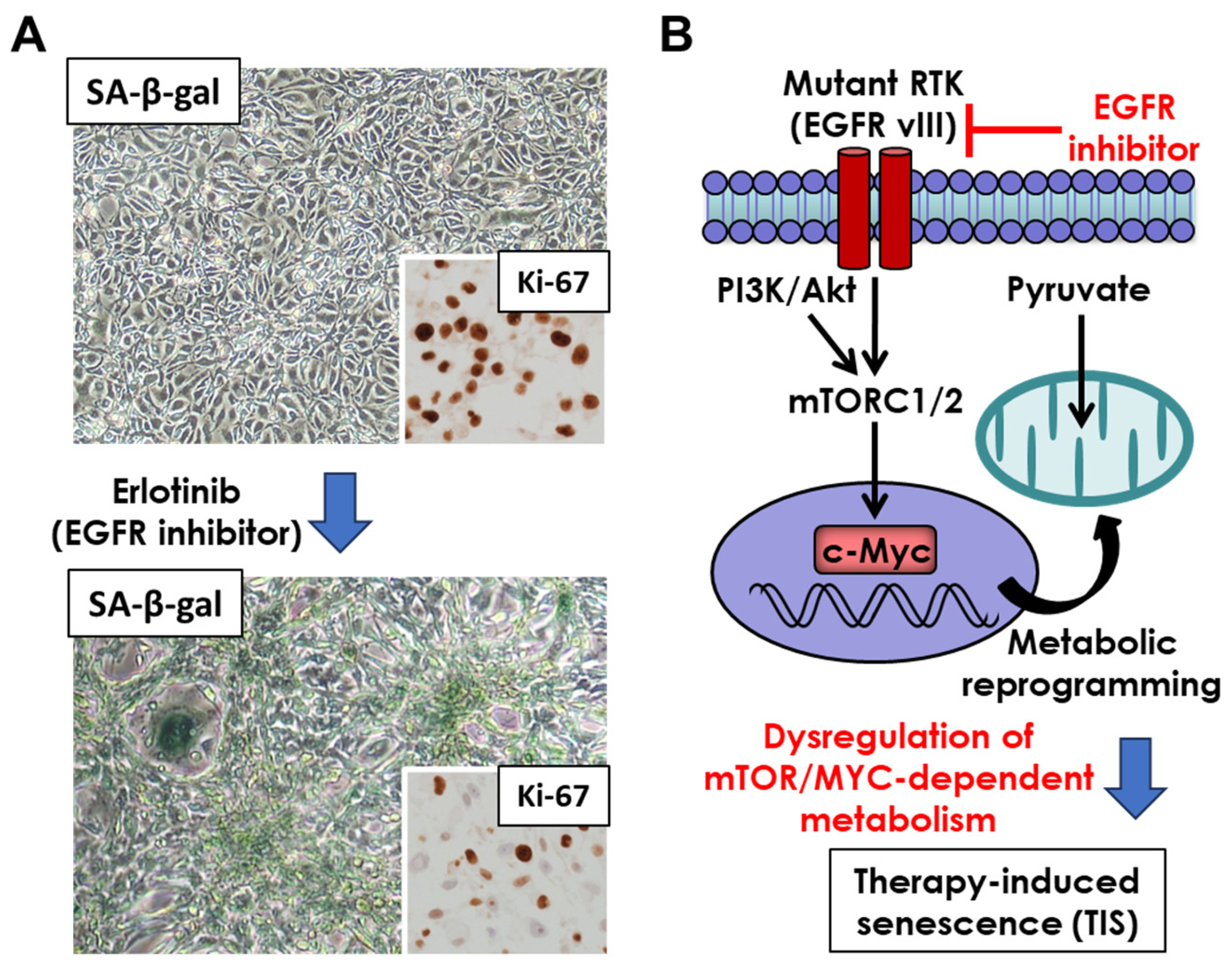The Paradox of Senescence in Glioblastoma: SASP as an Emerging Cancer ...