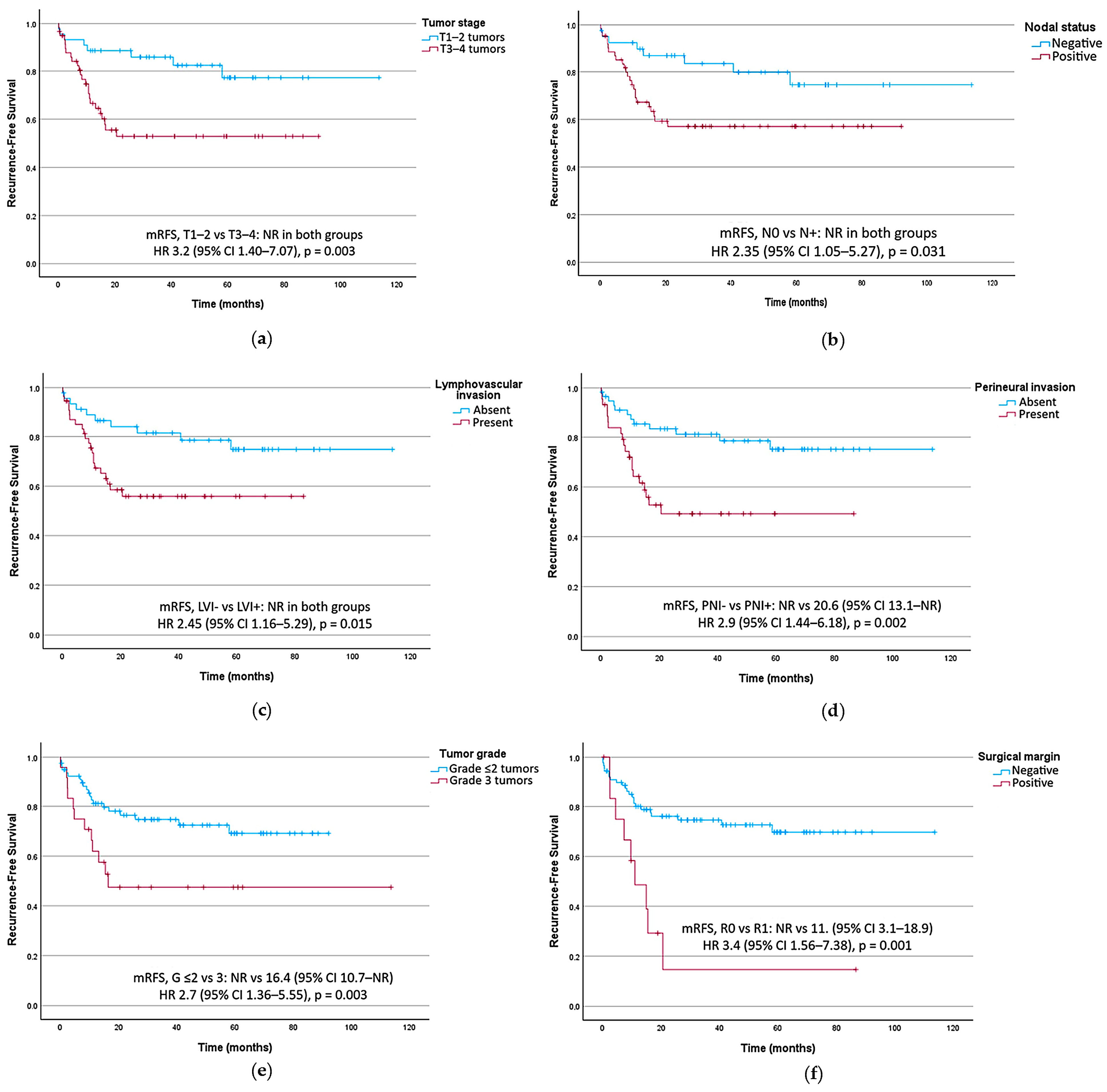 Ampullary Carcinoma: Prognostic Factors and a Literature Review