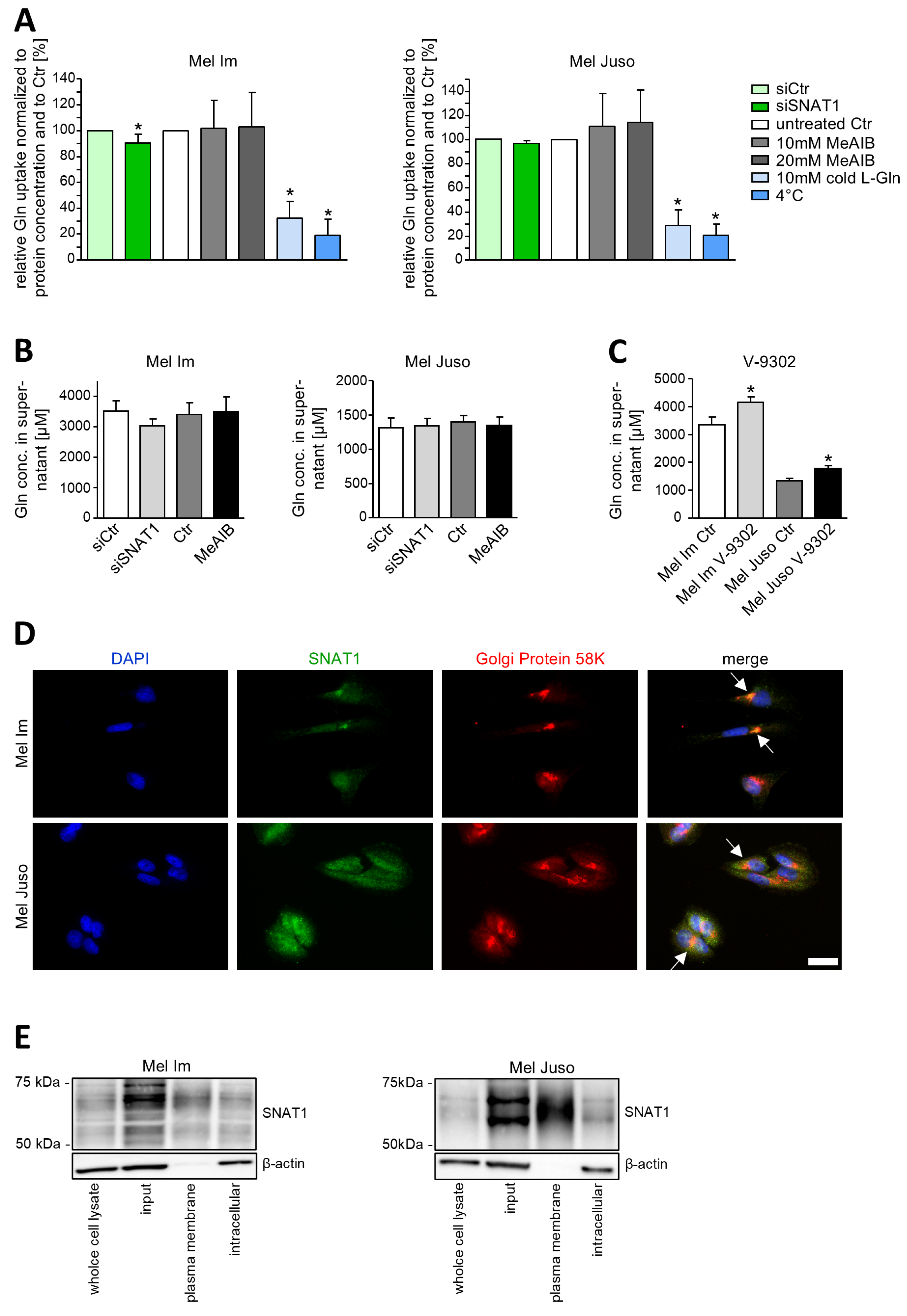 SNAT1 (SLC38A1) Is Not the Main Glutamine Transporter in Melanoma, but ...