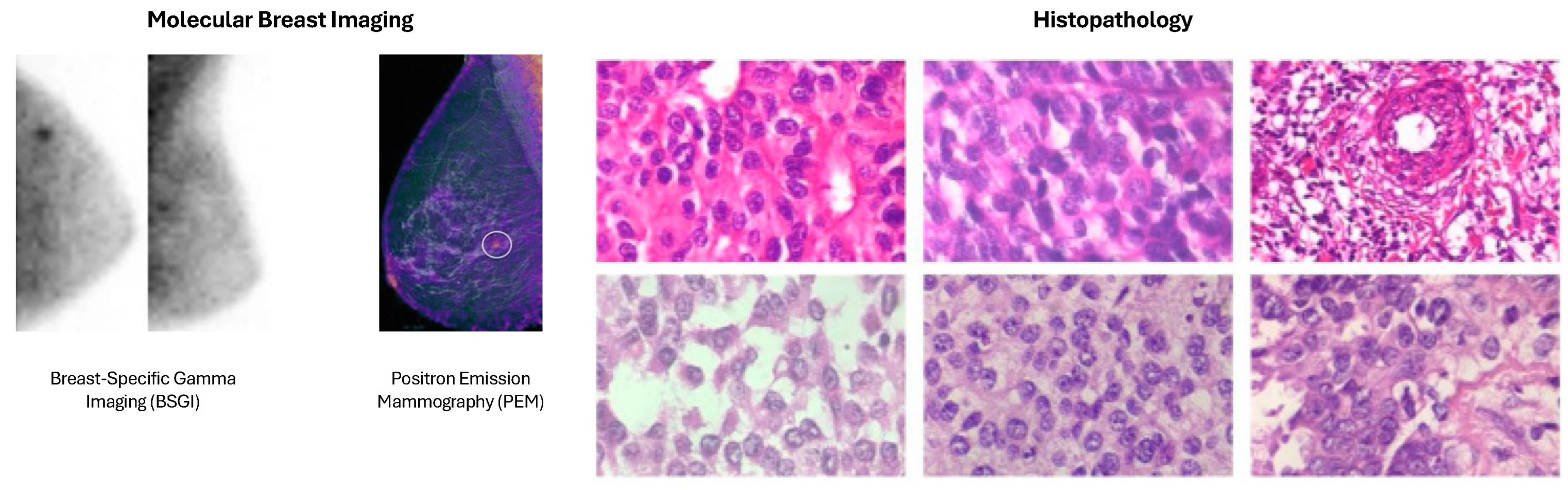 AI-Driven Breast Cancer Diagnosis: A Systematic Review of Imaging ...
