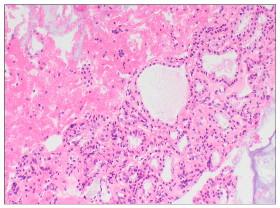 The Role of Cytology, Histology and Molecular Pathology in the ...