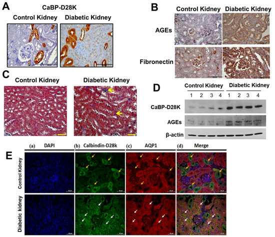 Role of Calbindin-D28k in Diabetes-Associated Advanced Glycation End ...