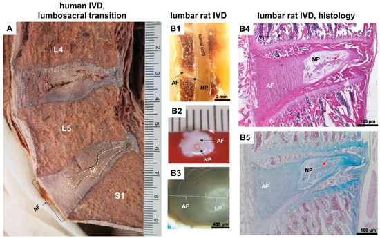 Cells | Free Full-Text | The Relationship between Diabetes Mellitus ...